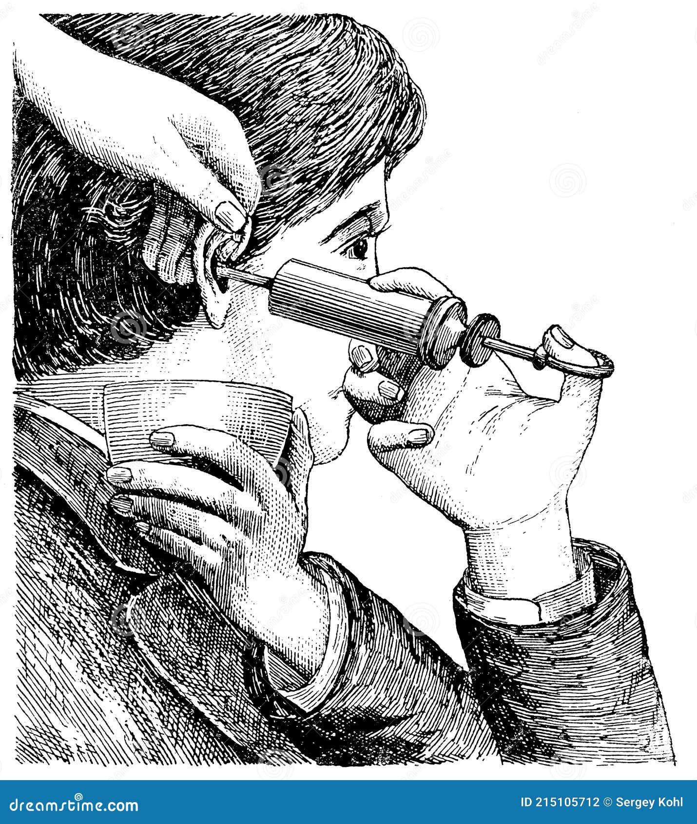Using the ear syringe. stock illustration. Illustration of engraving ...