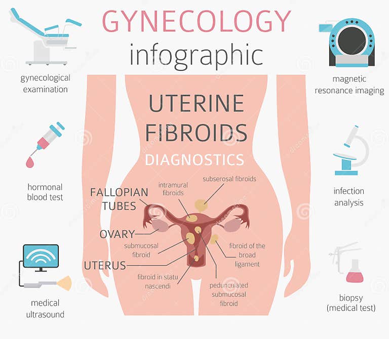 Uterine Fibroids Ginecological Medical Desease In Women Infographic