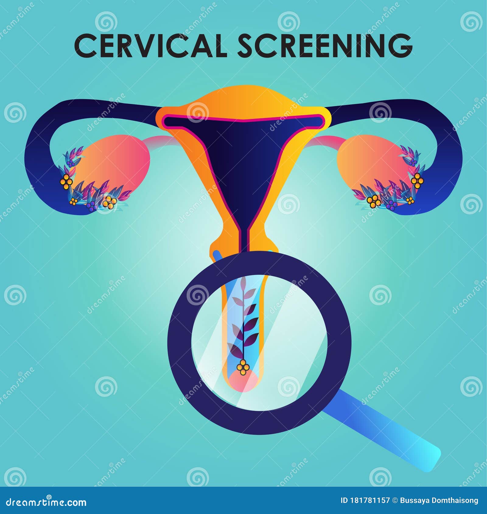 Cervical Screening, Gynecological Examining Concept. Cervix Cancer ...