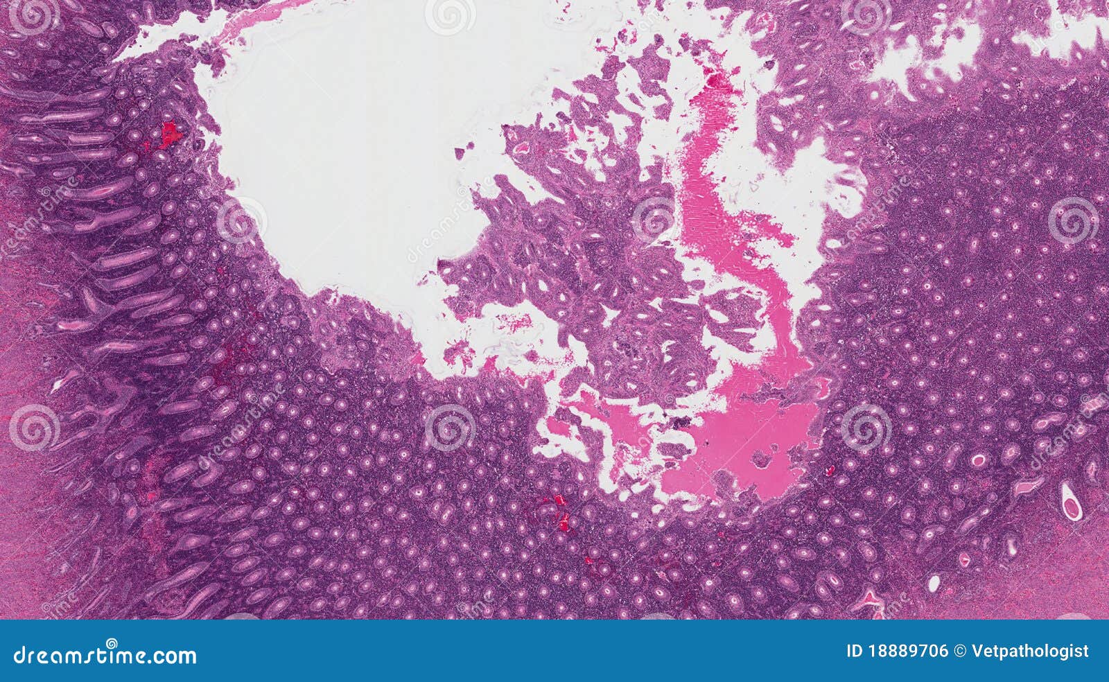 Uterus Menstrual Phase Of Microscopy