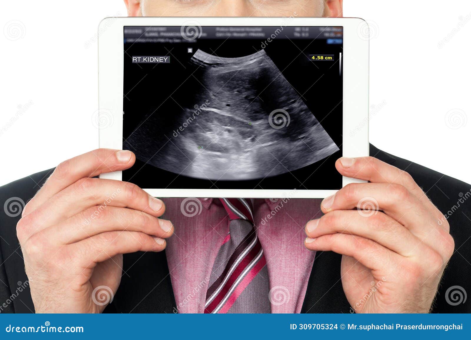 Utilizing His Tablet, the Man Showcases a Clear Ultrasound Image of the ...