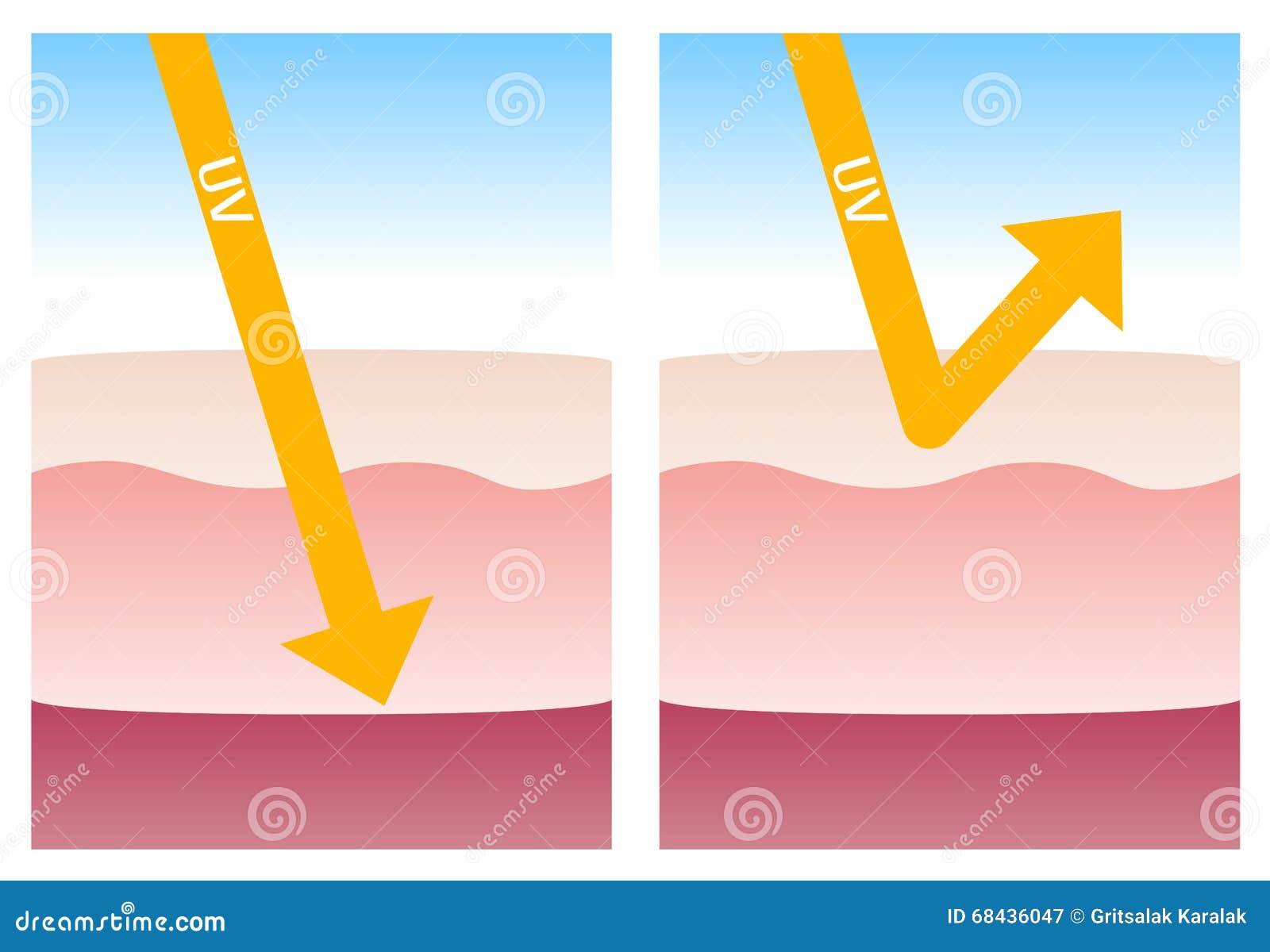 Protection And Penetrate Uv Rays From Sun Into Epidermis Of Skin Cross ...