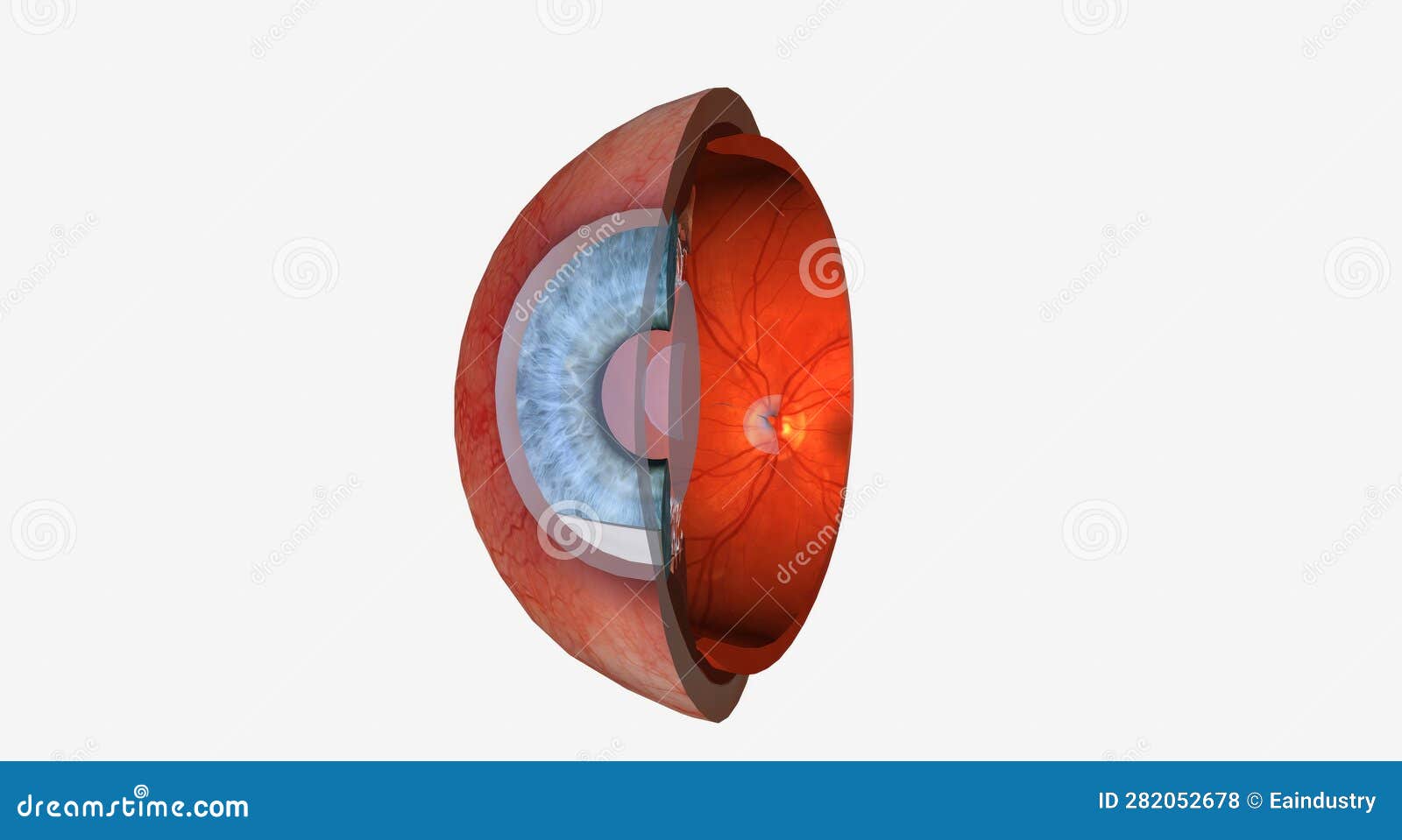 Uveitis is Swelling and Irritation of the Uvea, the Middle Layer Stock ...