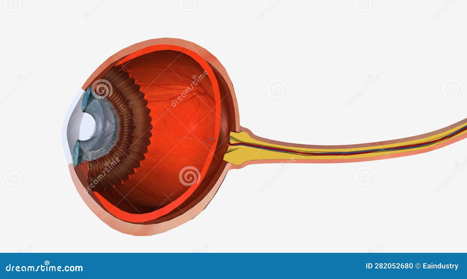 Uveitis is Swelling and Irritation of the Uvea, the Middle Layer Stock ...