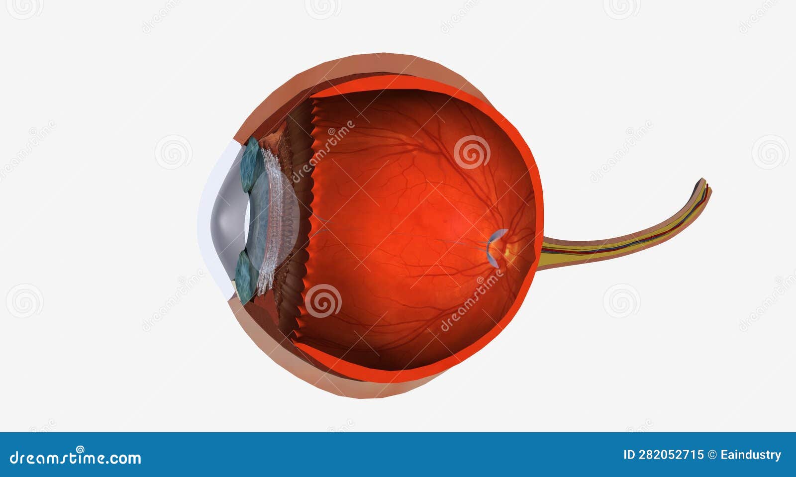 Uveitis is Swelling and Irritation of the Uvea, the Middle Layer Stock ...