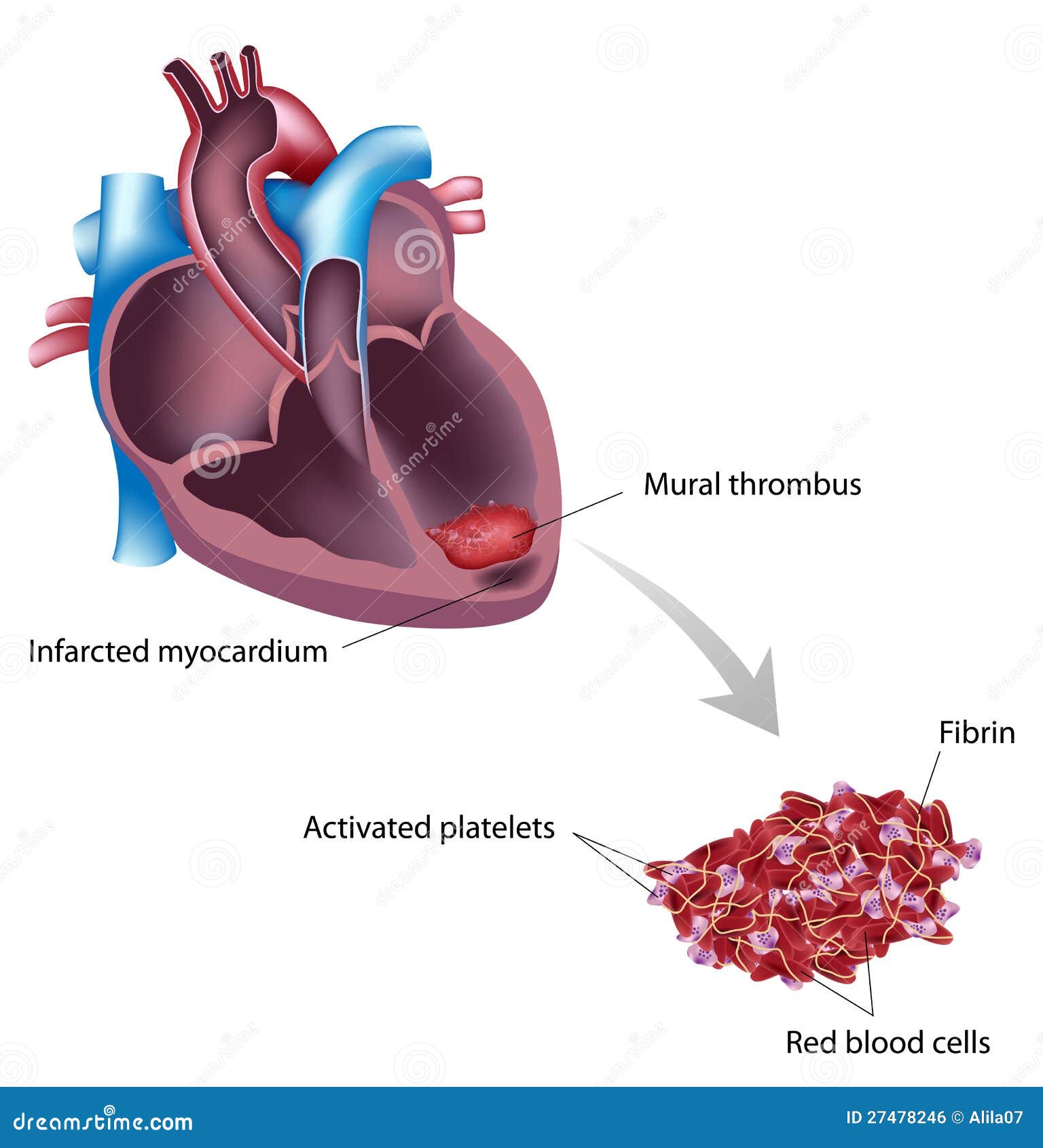 Vägg- tromb vektor illustrationer. Illustration av funktion - 27478246