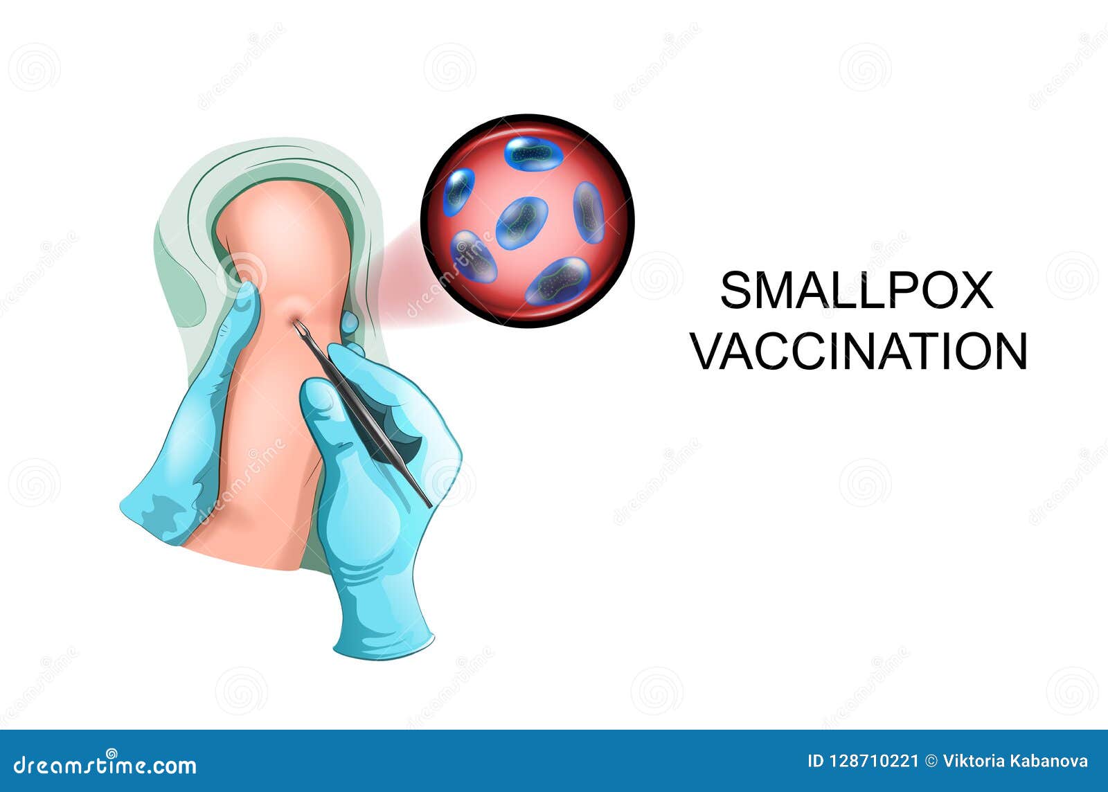 Smallpox Cartoons, Illustrations & Vector Stock Images - 2502 Pictures ...