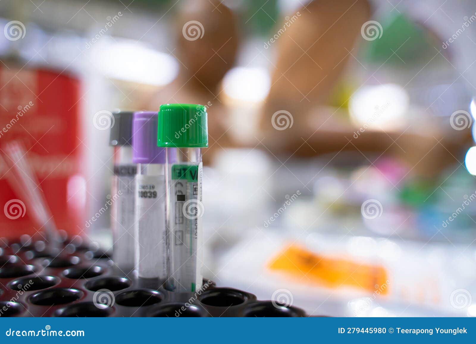 Vacuum Blood Sampling Tube for Medical Laboratory Stock Photo - Image ...