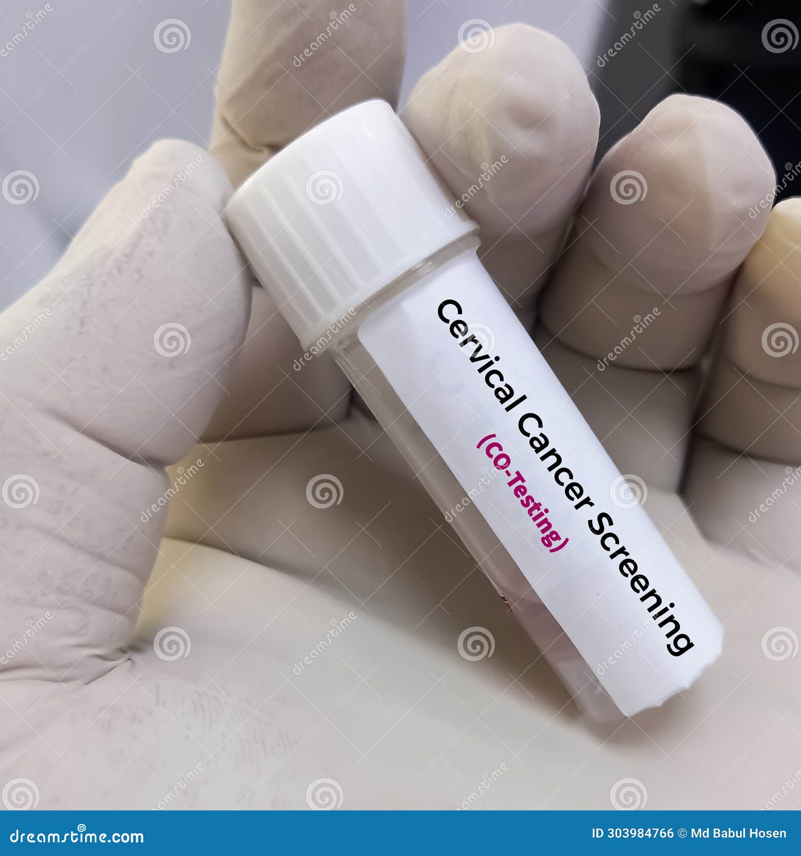 Vaginal Fluid Sample for Cervical Cancer Screening (CO-Testing), Stock ...