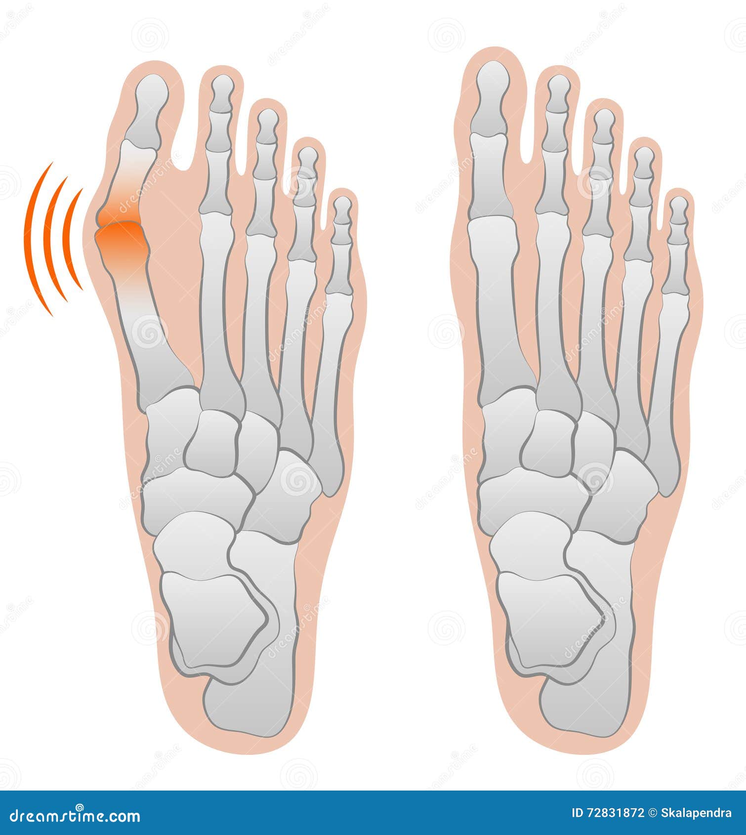 Deformity Cartoons, Illustrations & Vector Stock Images - 5915 Pictures ...