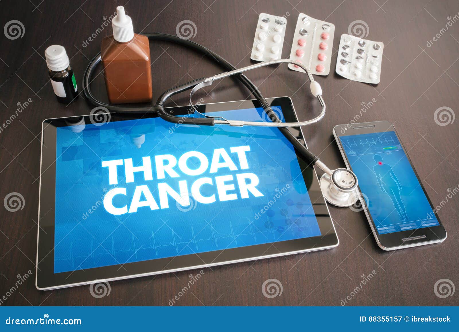 Van Keelkanker (kankertype) De Diagnose Medisch Concept Op Tablet Stock ...