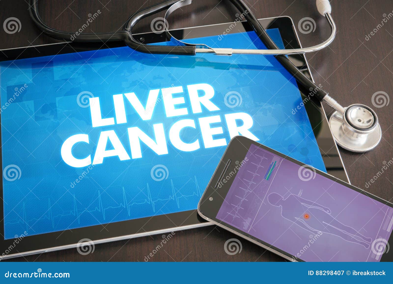 Van Leverkanker (kankertype) De Diagnose Medisch Concept Op Tablet S ...
