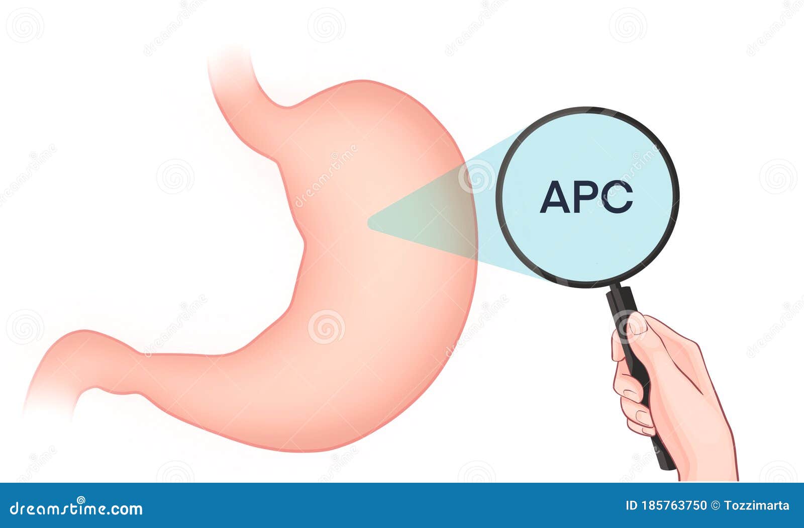 Variants of the APC Gene are Associated with an Increased Risk of ...