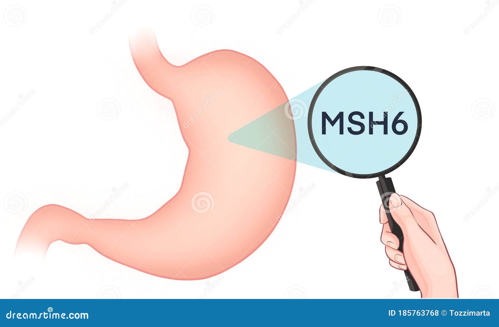 Variants of the MSH6 Gene are Associated with an Increased Risk of ...