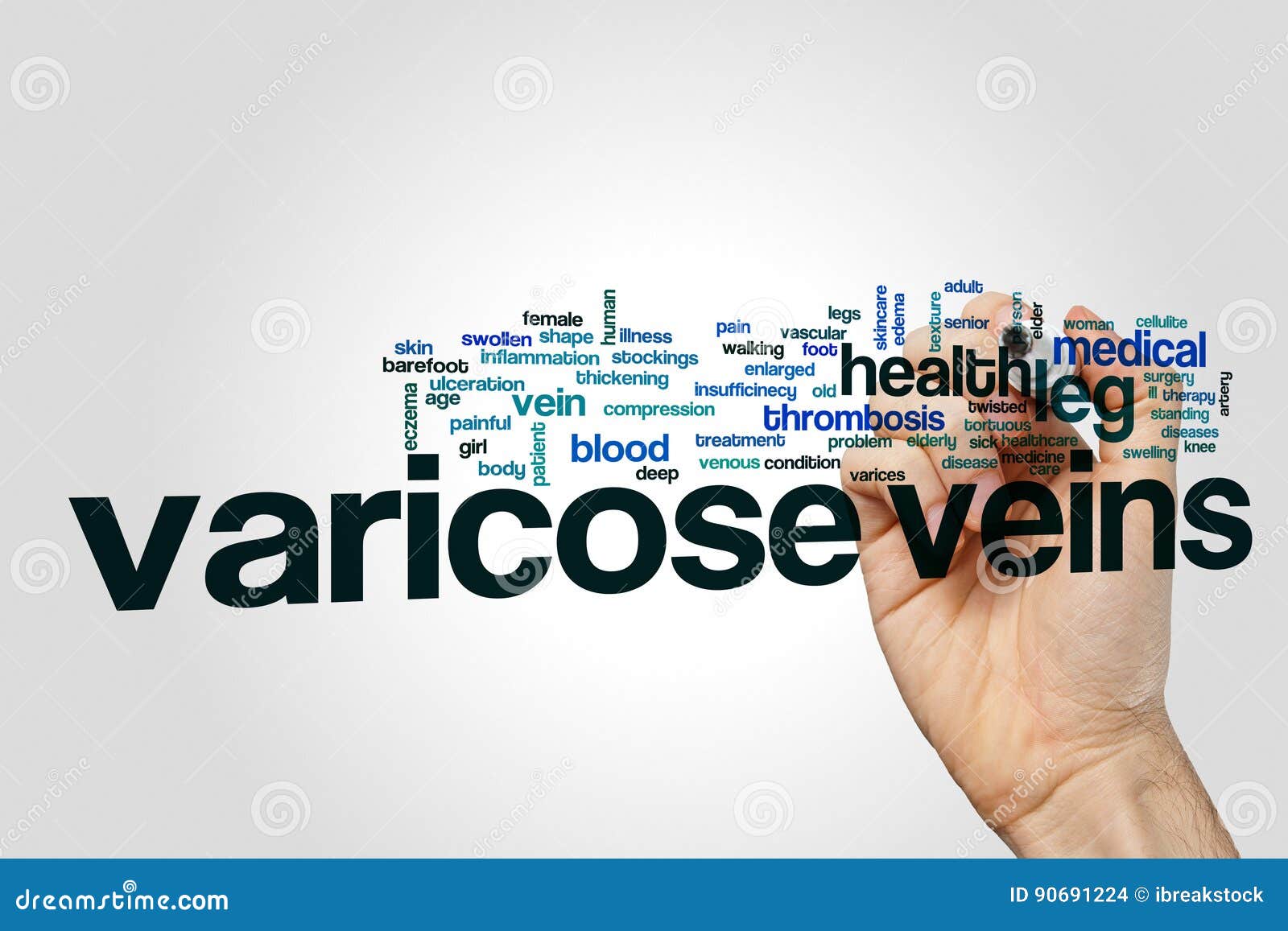 Varicose Veins Word Cloud Concept Stock Photo - Image of body, problem ...