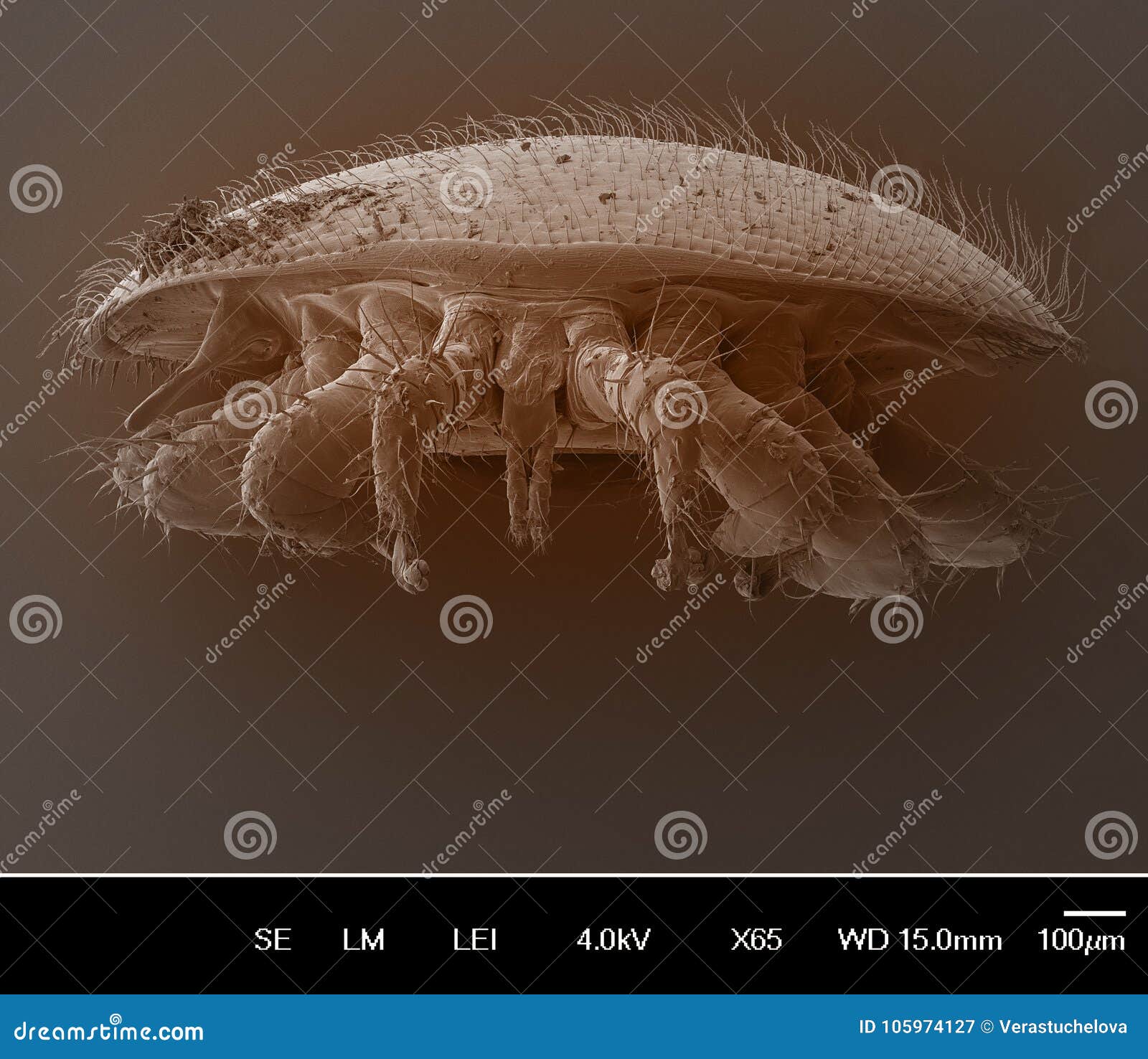 Parasite Electron Microscope