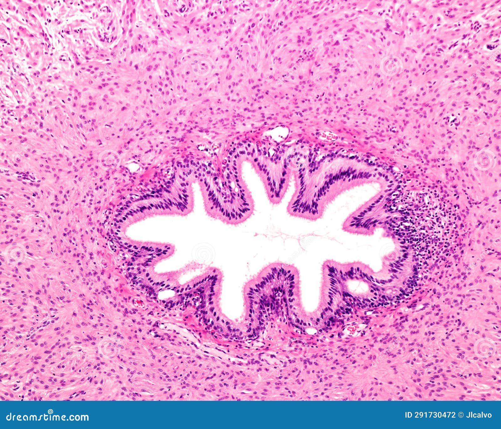 Vas deferens stock photo. Image of spermatic, paraffin - 291730472