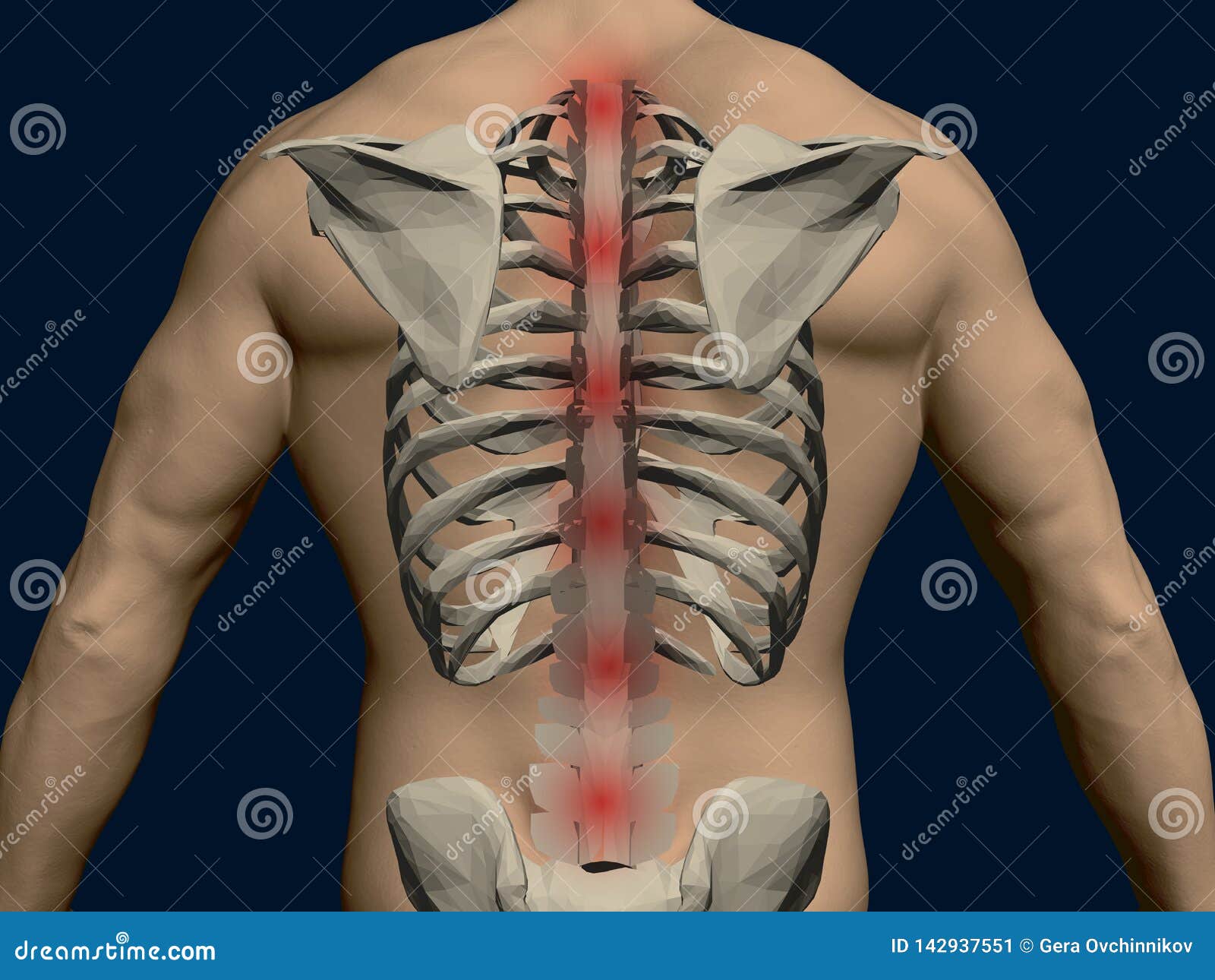 Vector Back of a Man with a Skeleton. Red Sore Points Along the Spine ...