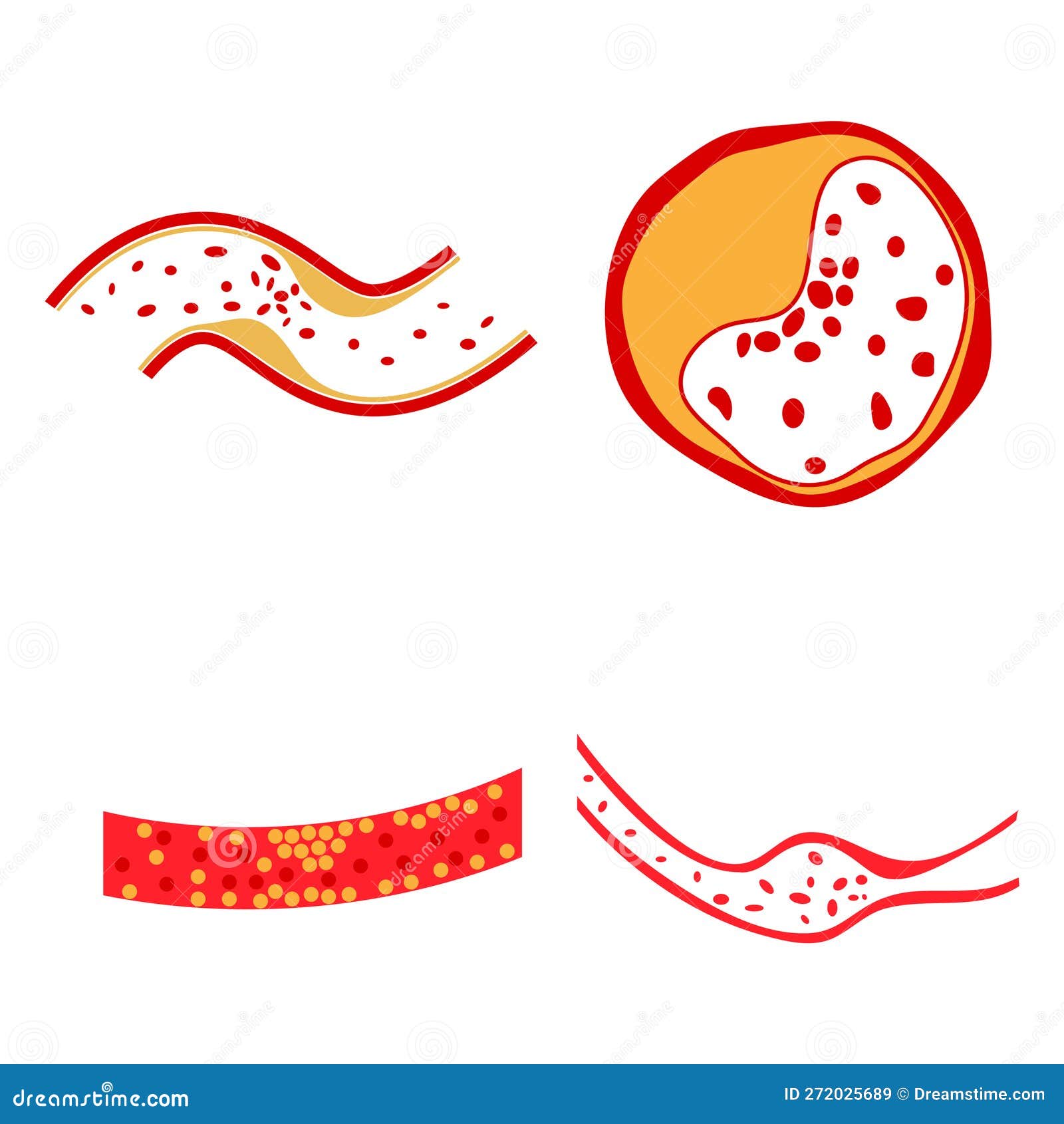 Vector Of Cholesterol Plaque Logo Icon Illustratrion | CartoonDealer ...