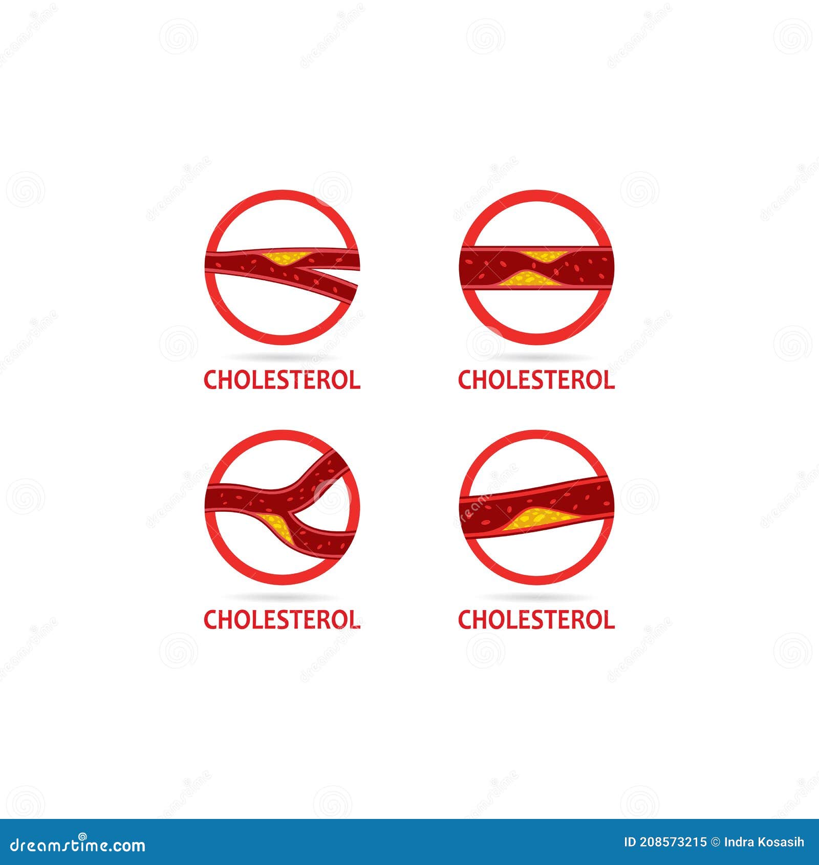 Vector of Cholesterol Plaque Logo Icon Illustratrion Stock Vector ...