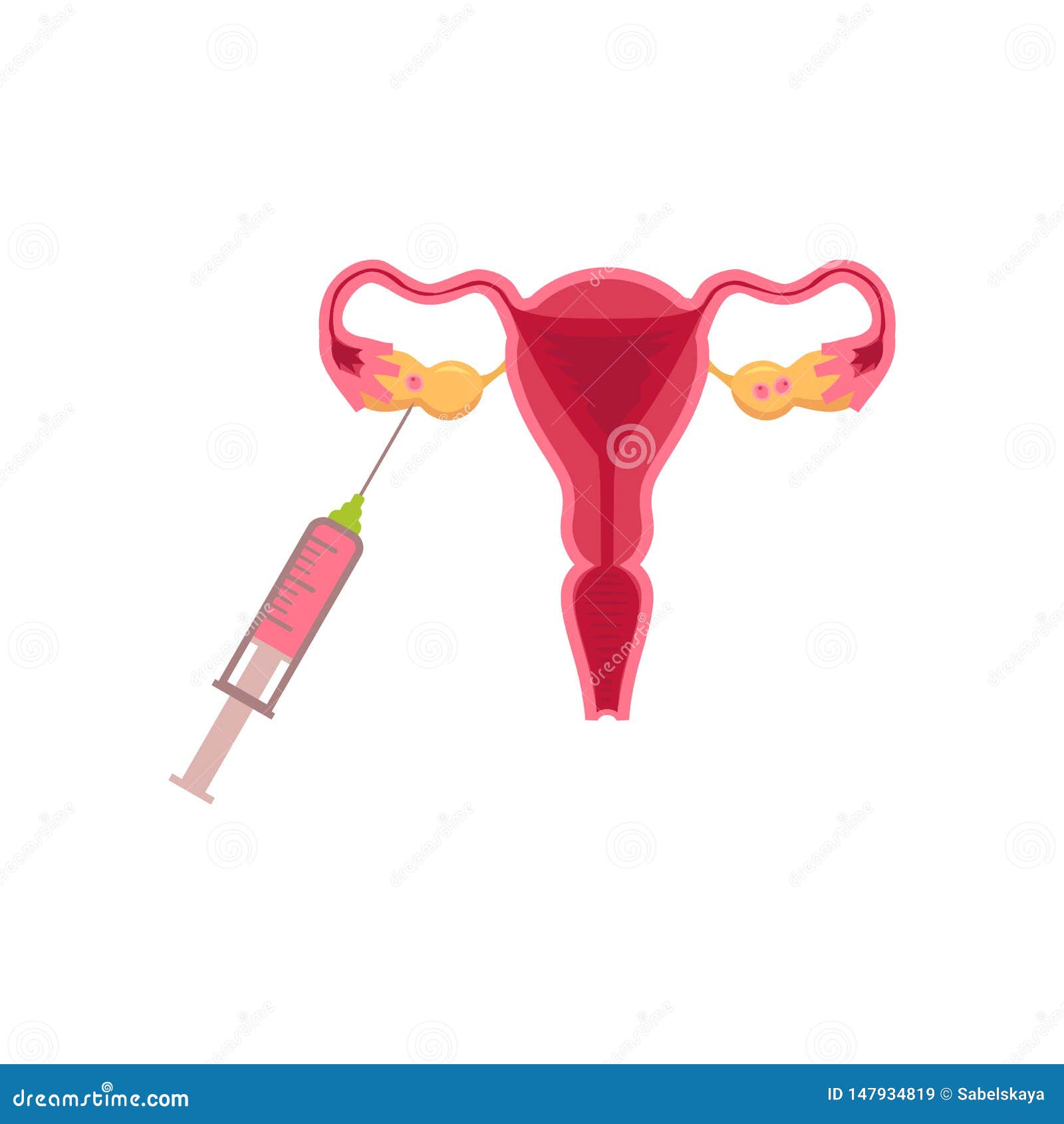 Vector Del Concepto De La Inseminación Artificial Y Del Tratamiento De