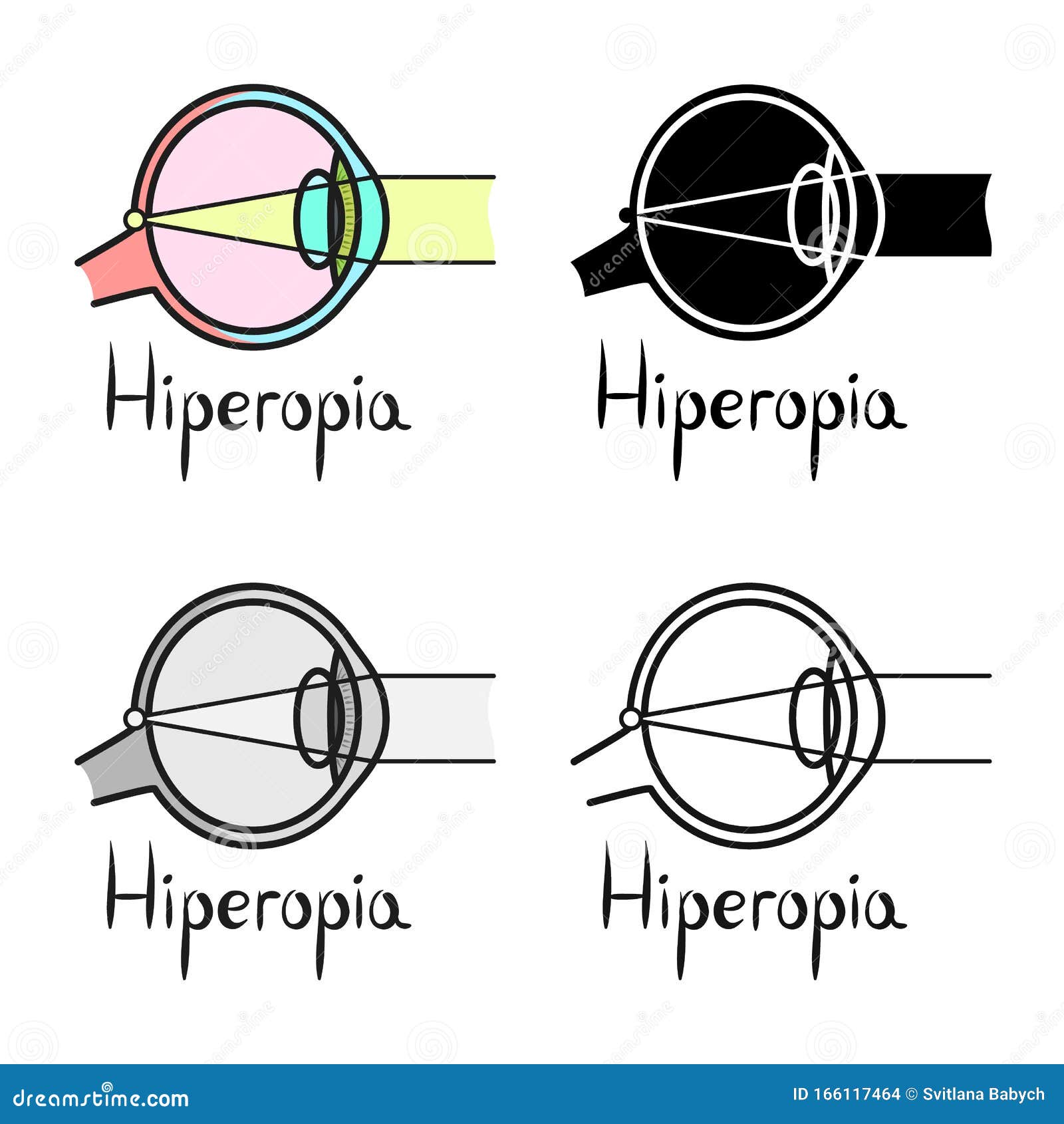 Vector Design of Hyperopia and Eyeball Symbol. Web Element of Hyperopia ...