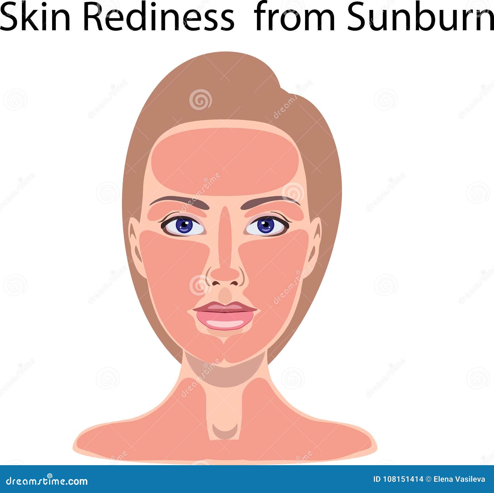 Vector Face with Burnt Skin Stock Vector - Illustration of cute, hurt ...