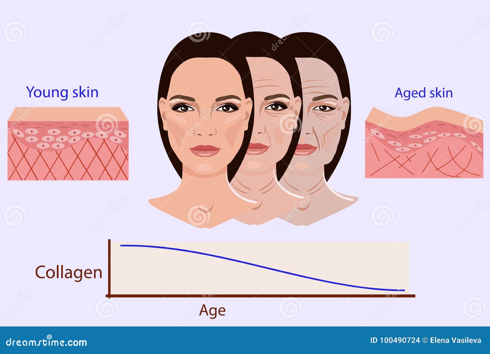 Vector Face and Two Types of Skin - Aged and Young for Medical and ... Vector Face and Two Types of Skin - Aged and Young for Medical and ...