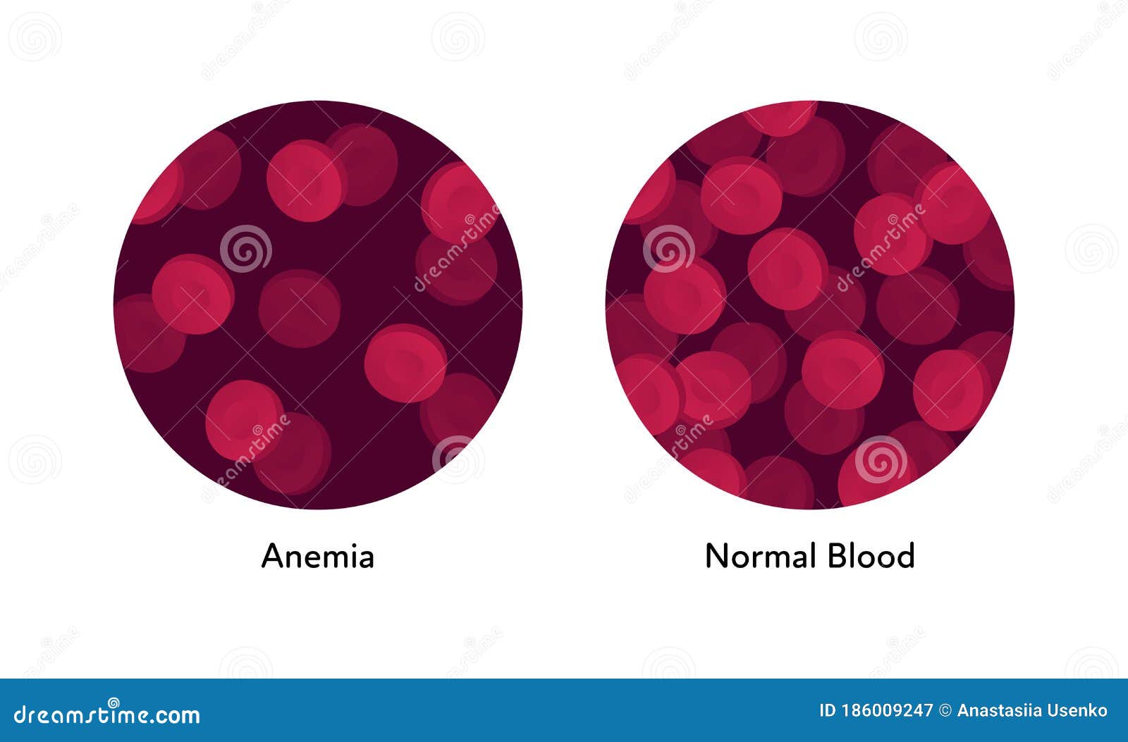 Vector Flat Blood Cell Illustration. Red Gradient Erythrocytes in Set ...