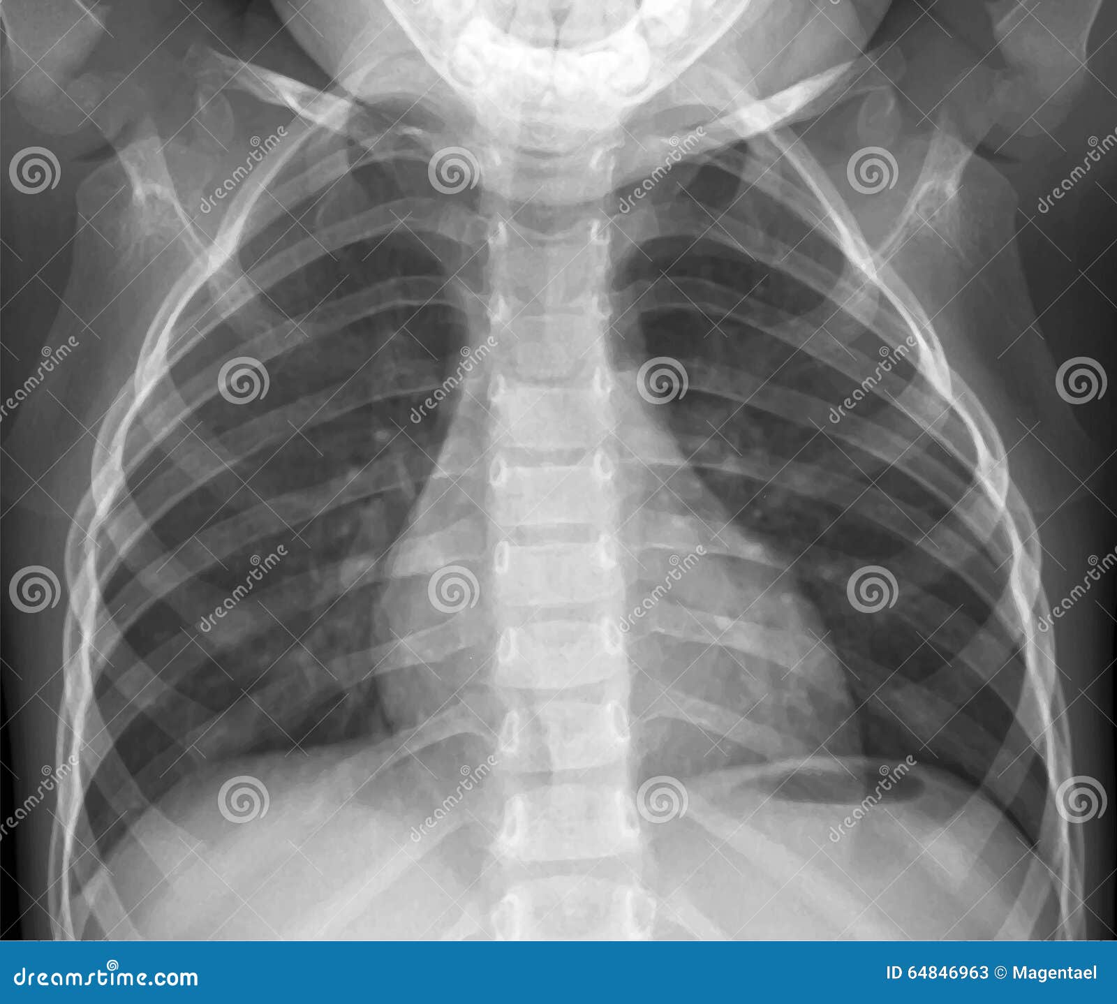 Vector Flat Icon X-ray of Human Thorax. Anatomy Stock Vector ...