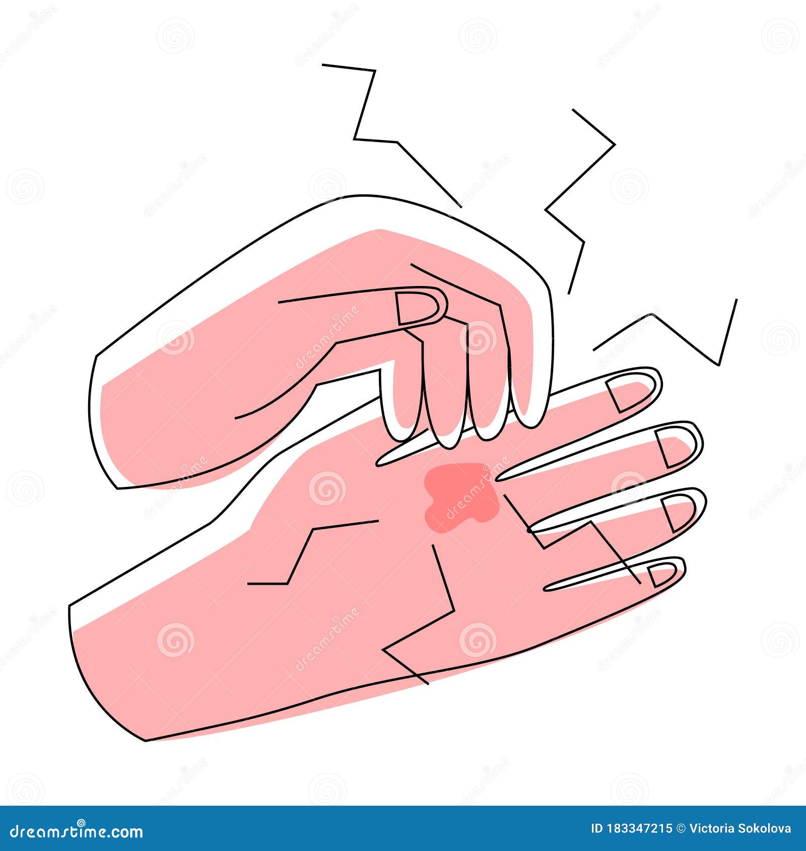 Vector Flat Illustration with Isolated Hands Where One Scratches Other ...