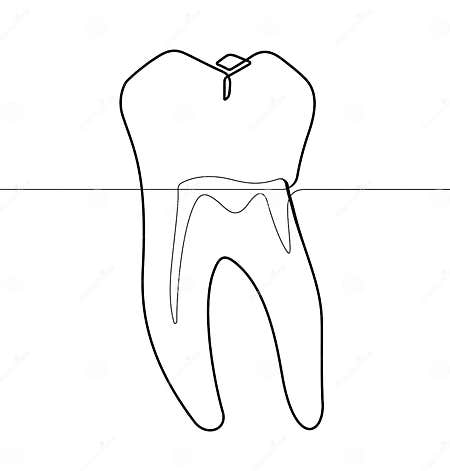 Molar Human Tooth Continuous Line Vector Graphic Stock Vector ...