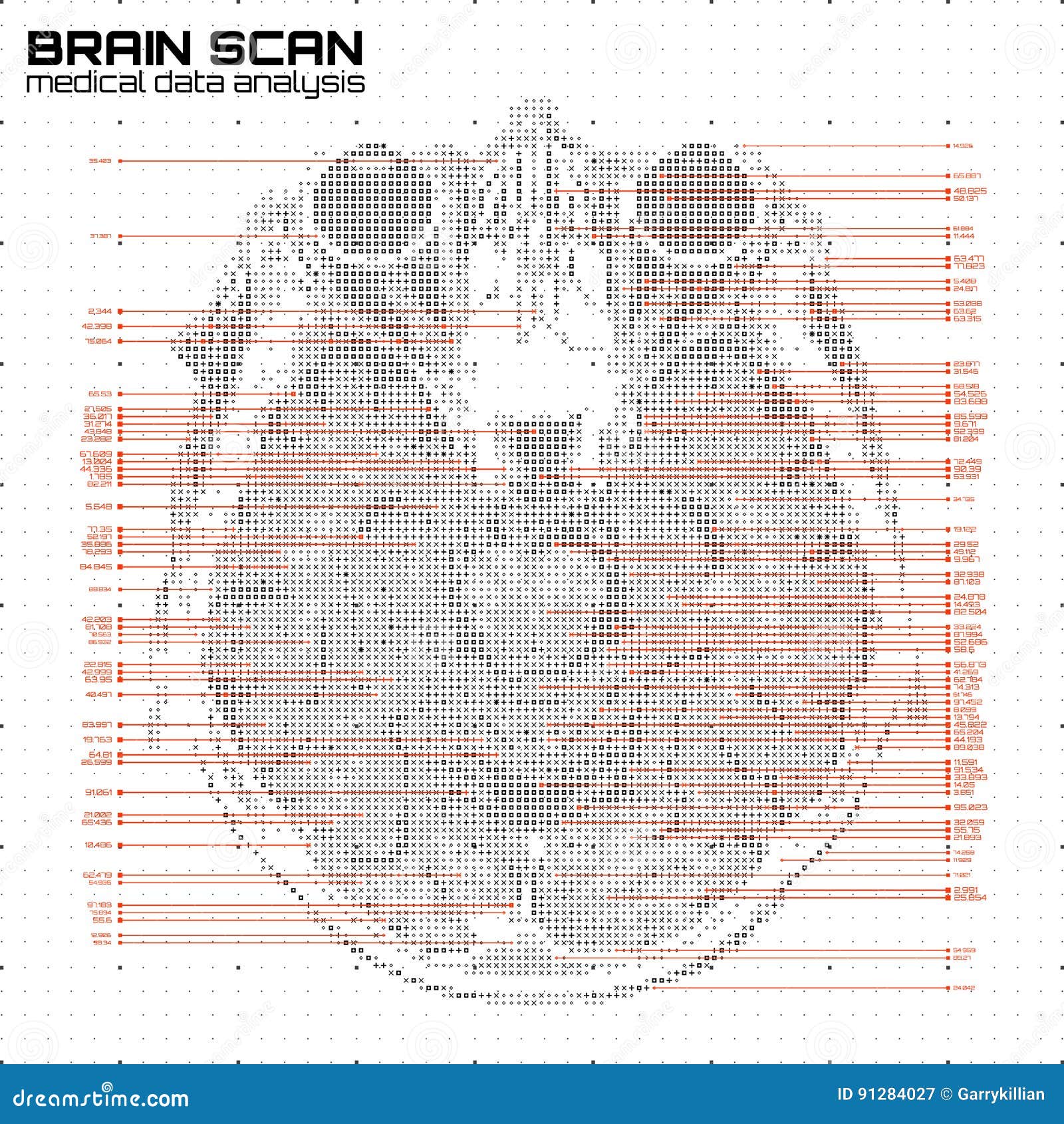Brain MRI Tomography Vector Cartoon Illustration Of Doctor And Patient ...