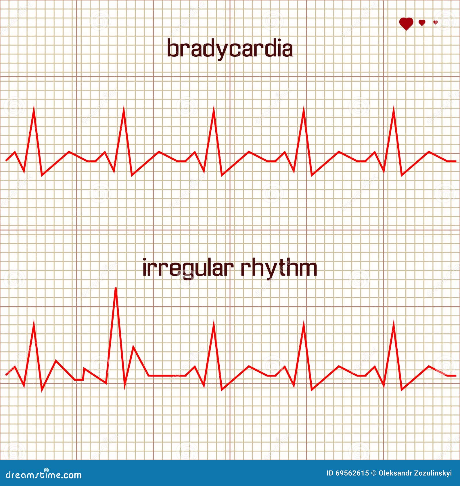Vector Heart Beats Cardiogram Stock Vector Illustration Of Beam