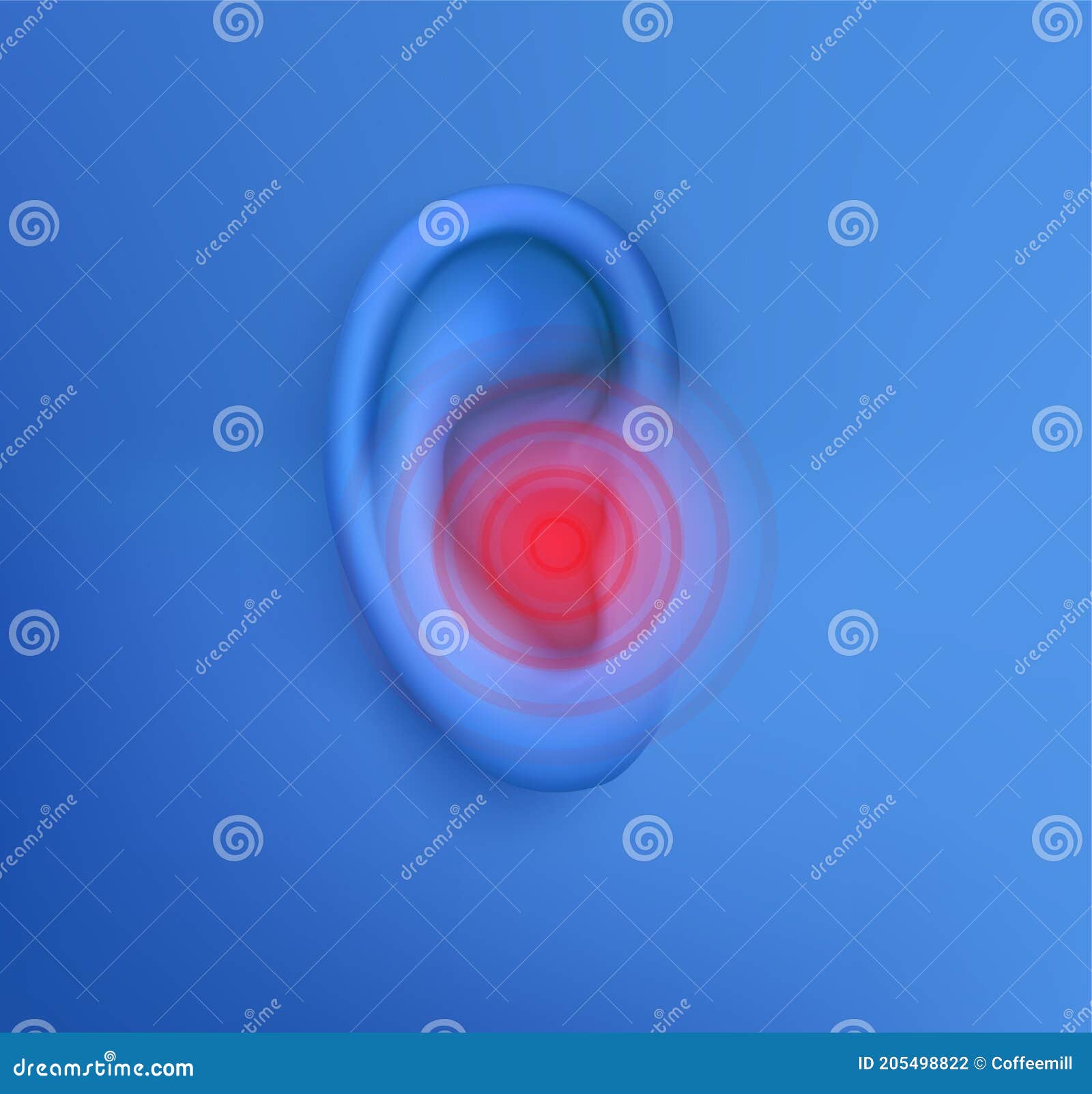 Mastoiditis Cartoons, Illustrations & Vector Stock Images - 21 Pictures ...