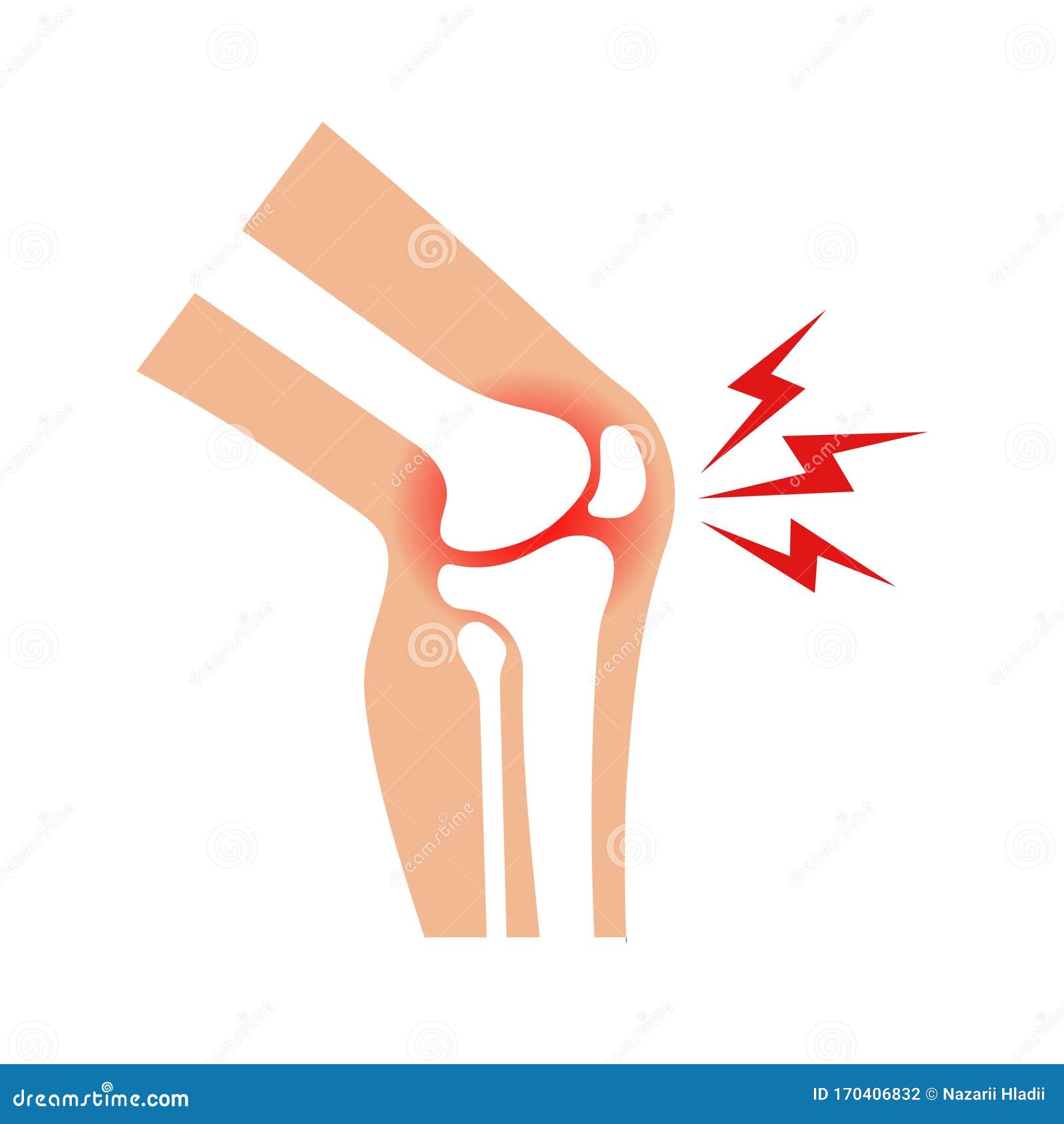 The Joints Hemophilia. Bleeding. Injury. Cartoon Vector | CartoonDealer ...
