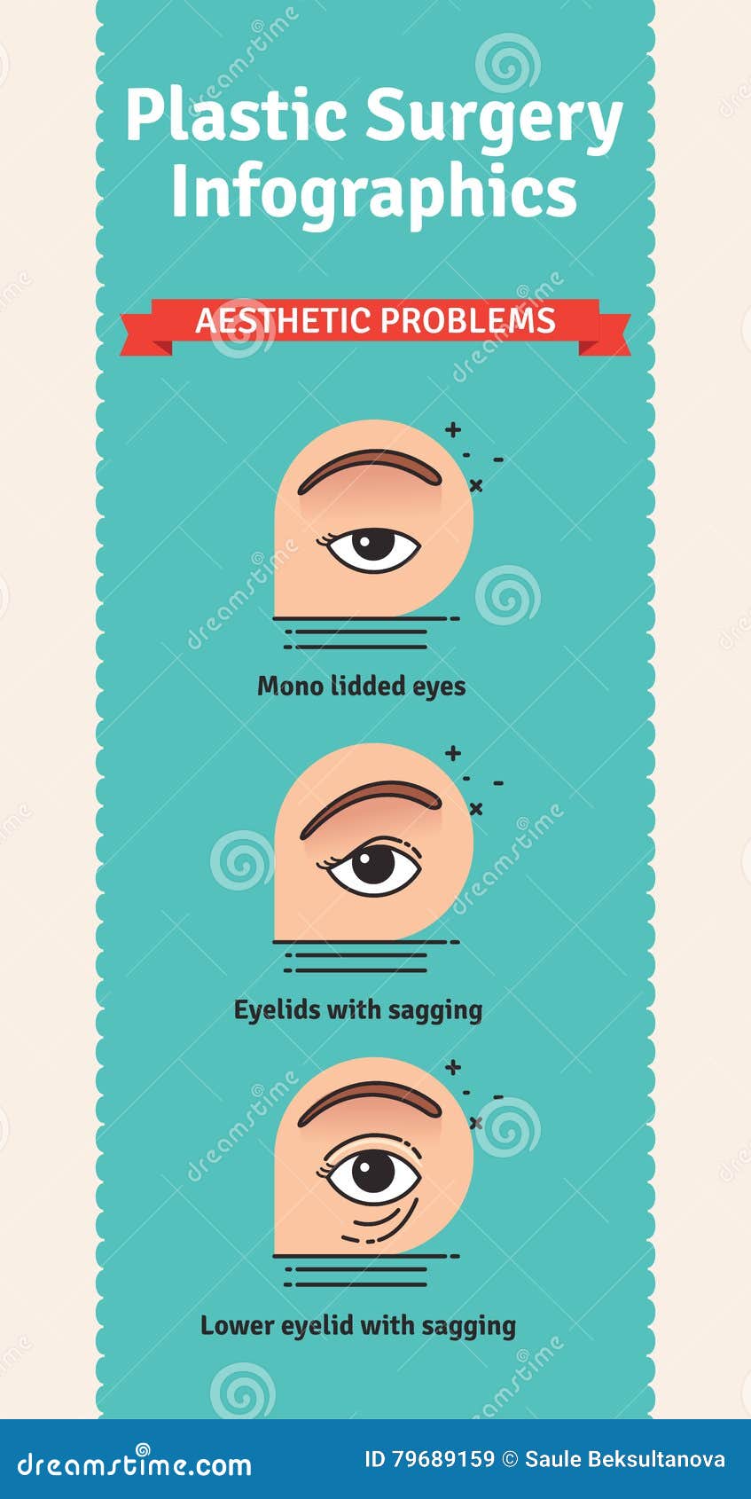 Lower Blepharoplasty Of Eyelid , Before And After. Vector Illustration ...
