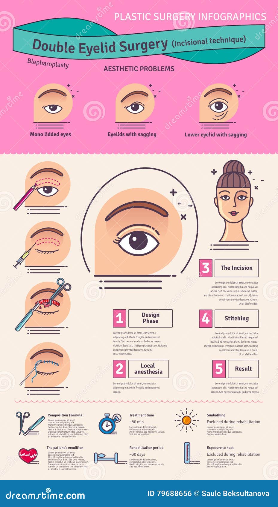 Vector Illustrated Set With Double Eyelid Surgery | CartoonDealer.com ...