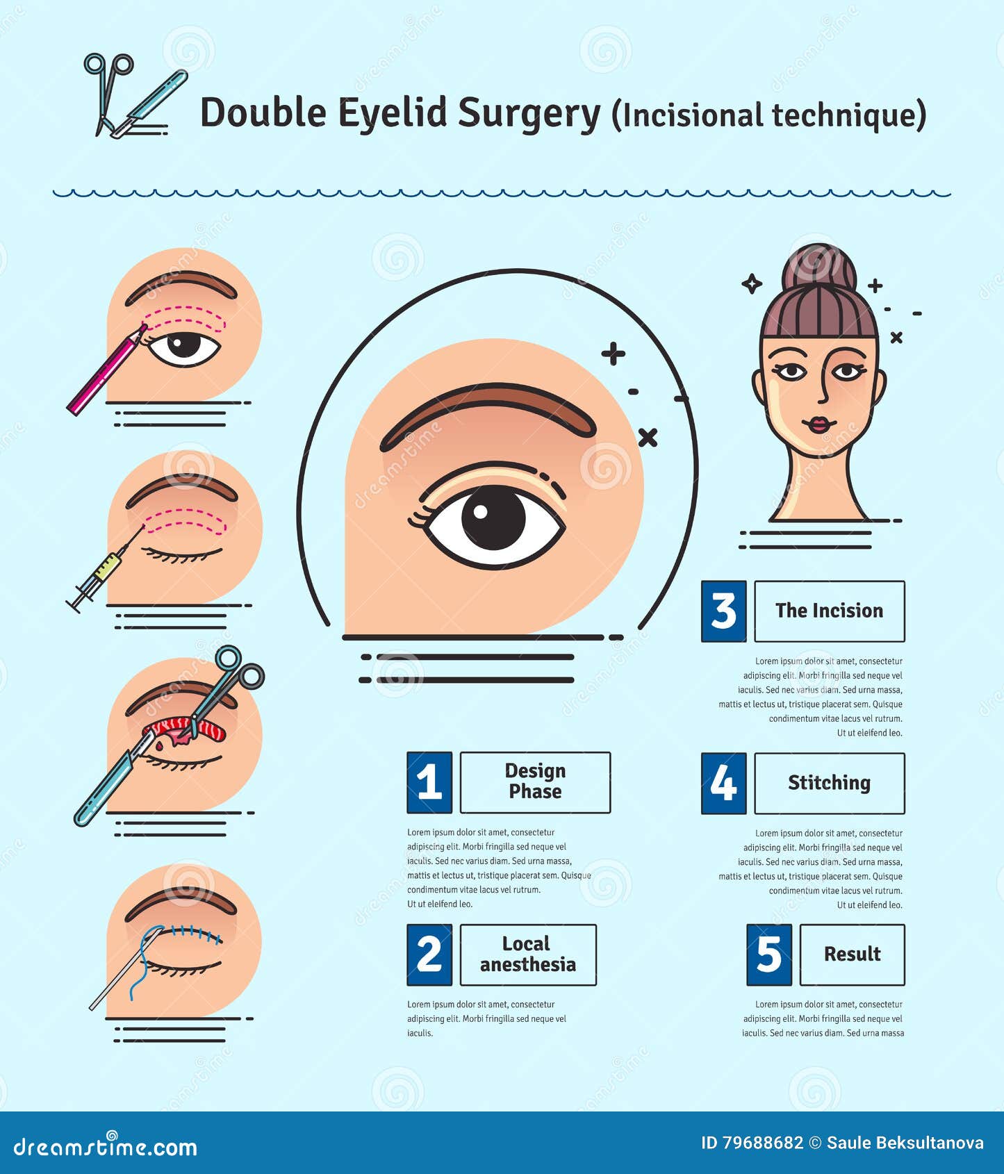 Vector Illustrated Set with Double Eyelid Surgery Stock Vector ...