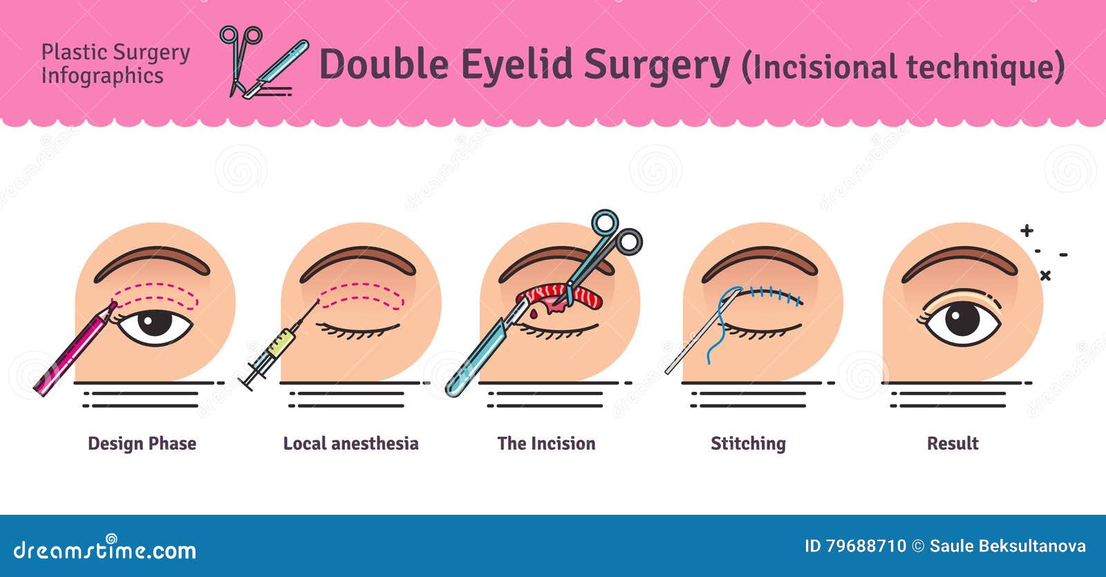 Eyelid Surgery, Plastic Surgery Cartoon Vector | CartoonDealer.com ...