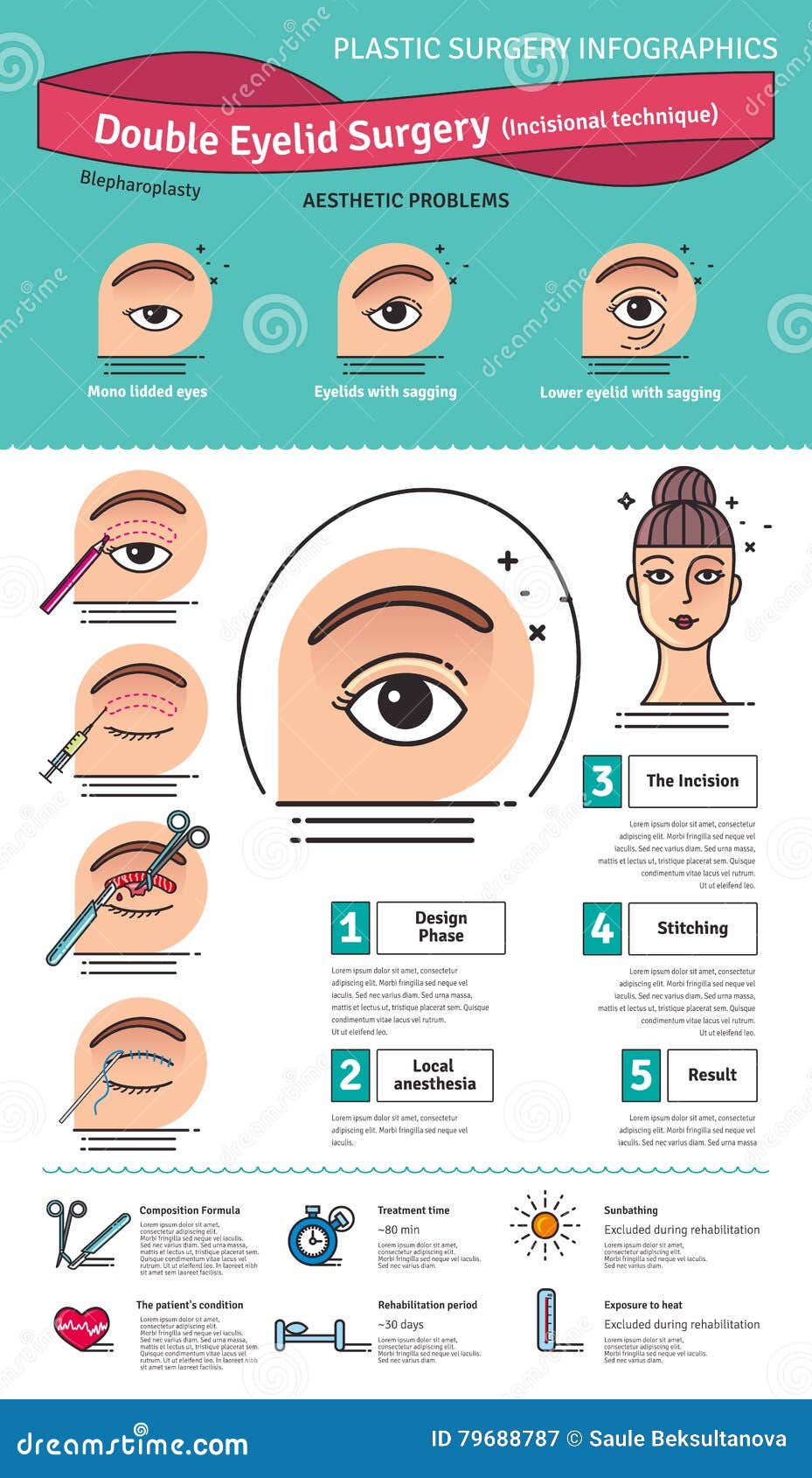 Procedures Of Double Eyelids Surgery. Vector Illustration ...