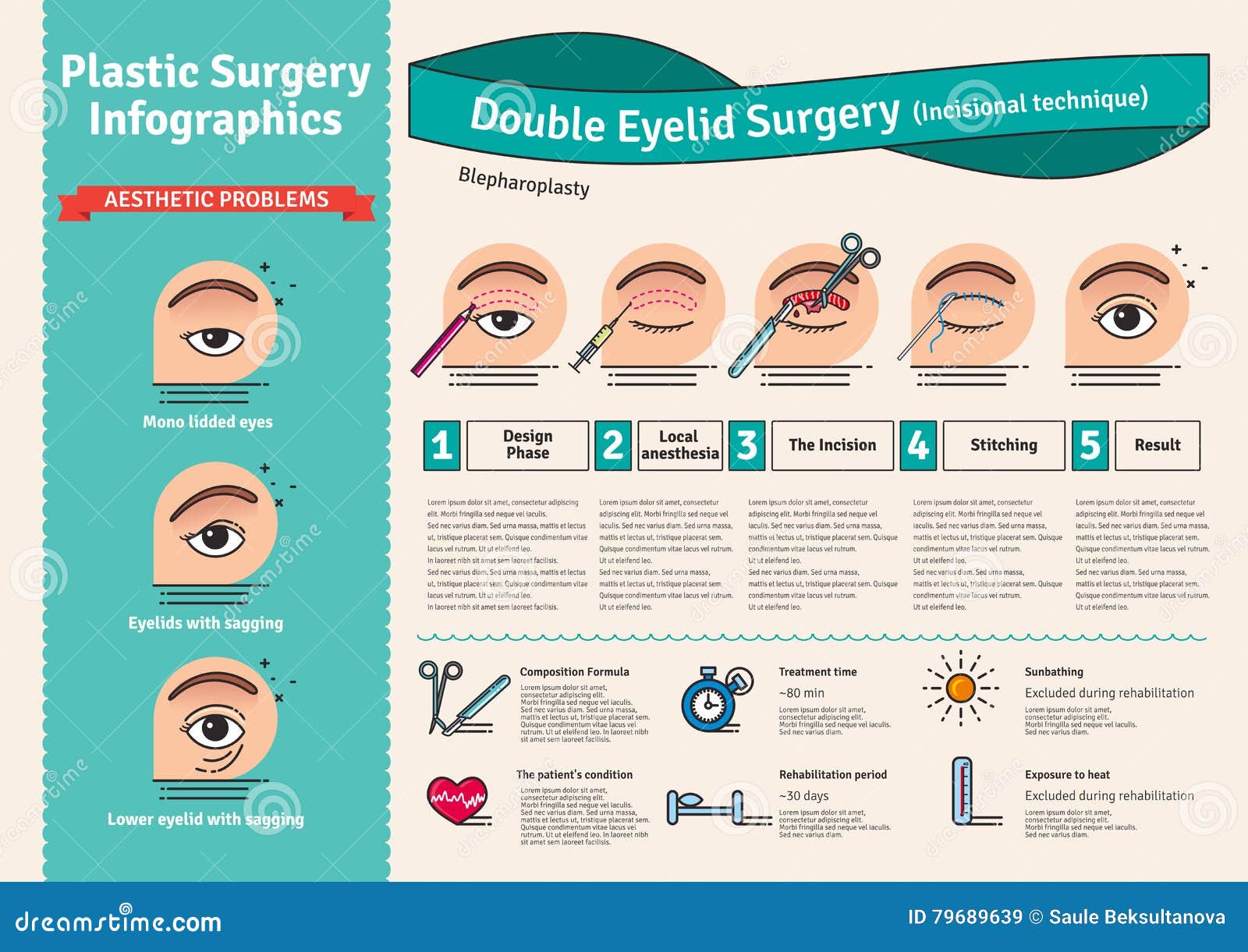 Vector Illustrated Set with Double Eyelid Surgery Stock Illustration ...