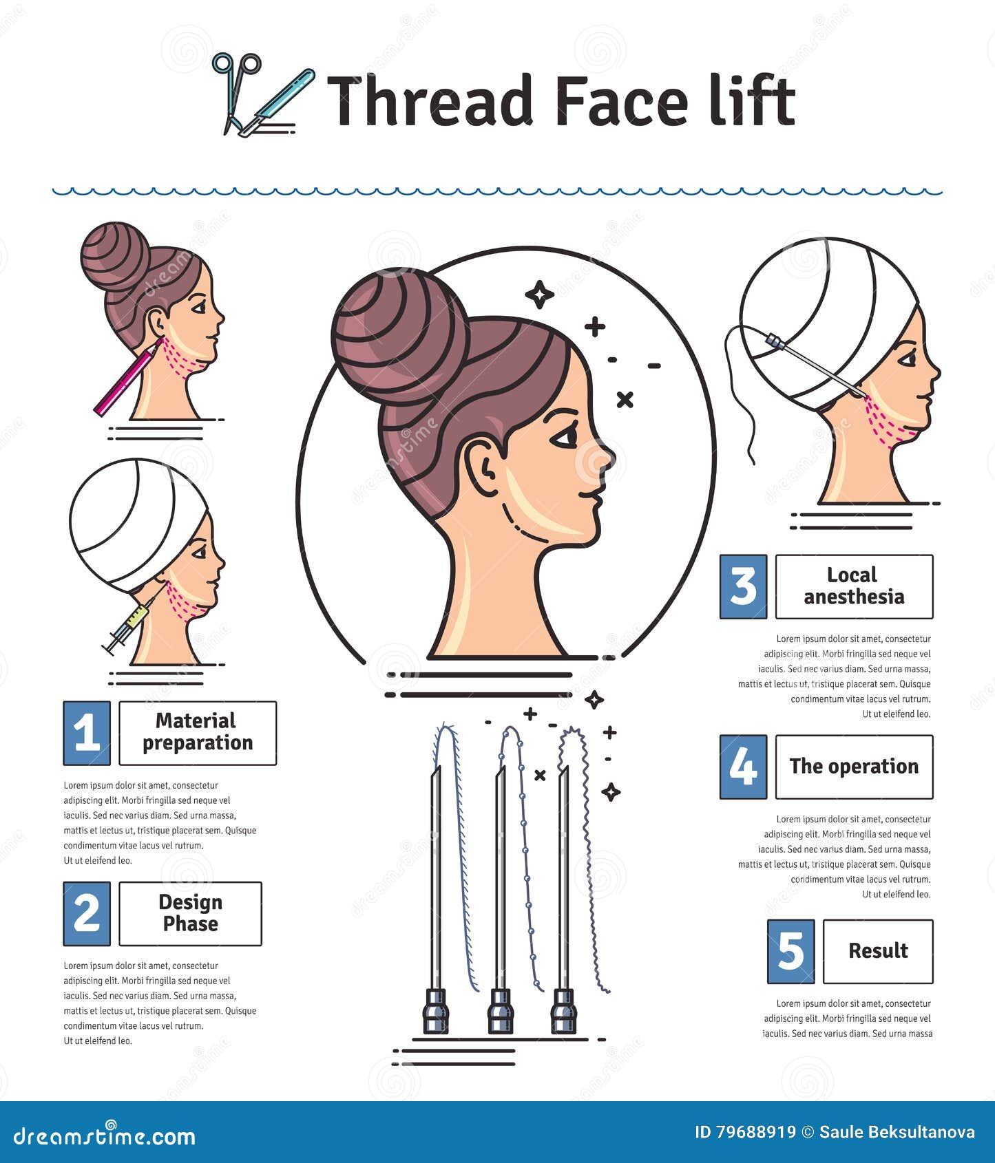 Vector Illustrated Set with Face Lifting Surgery by Threads Stock ...