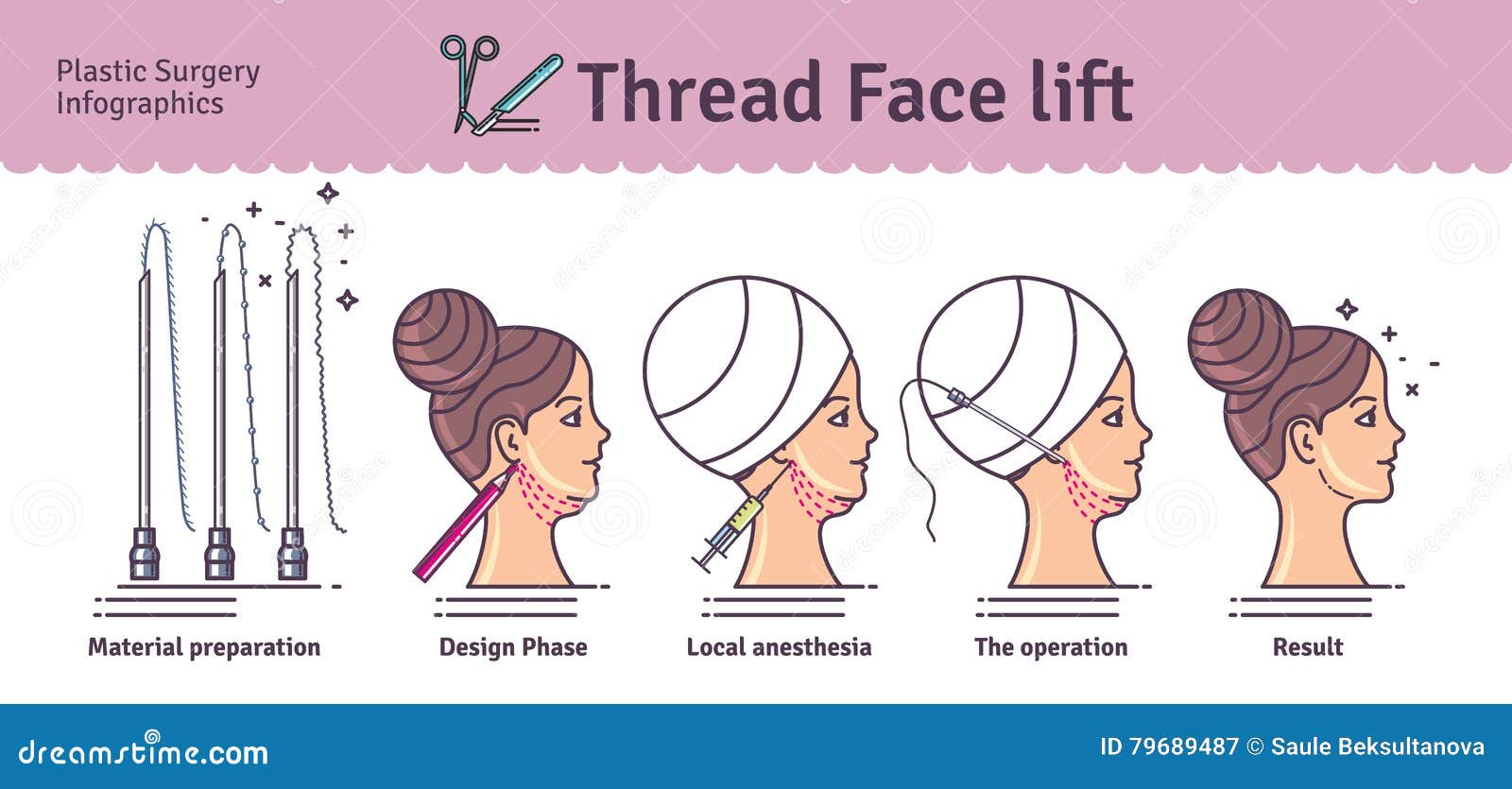Vector Illustrated Set with Face Lifting Surgery by Threads Stock ...