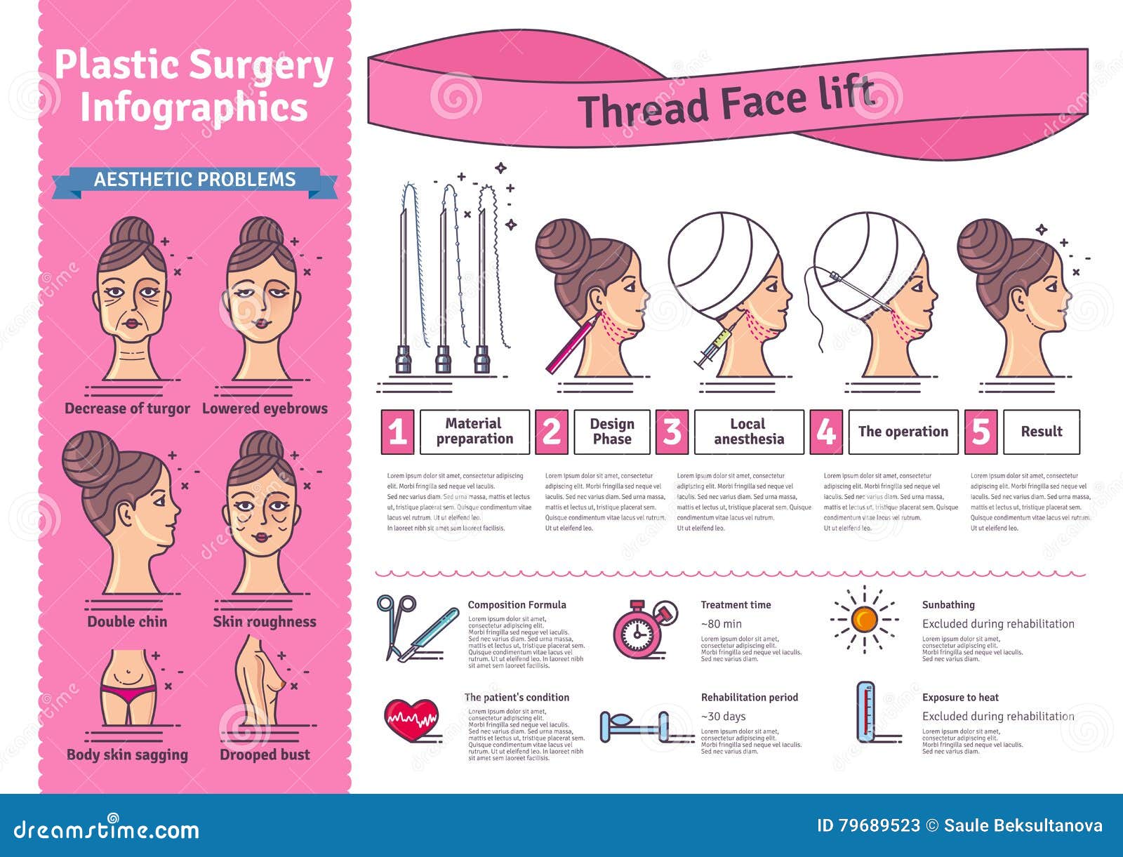 Vector Illustrated Set with Face Lifting Surgery by Threads Stock ...