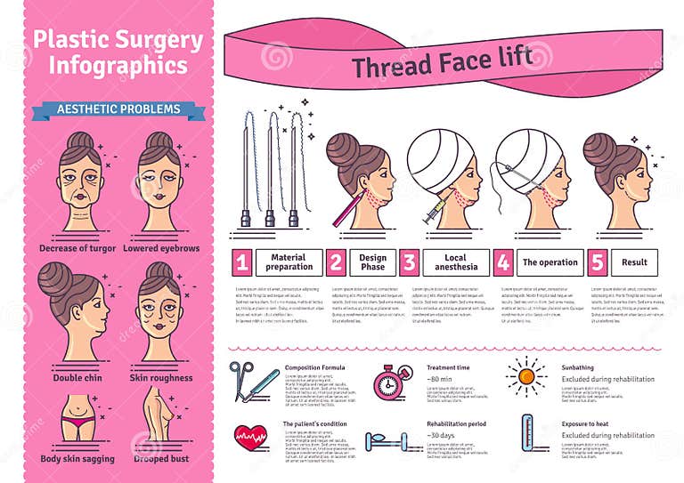 Vector Illustrated Set with Face Lifting Surgery by Threads Stock ...