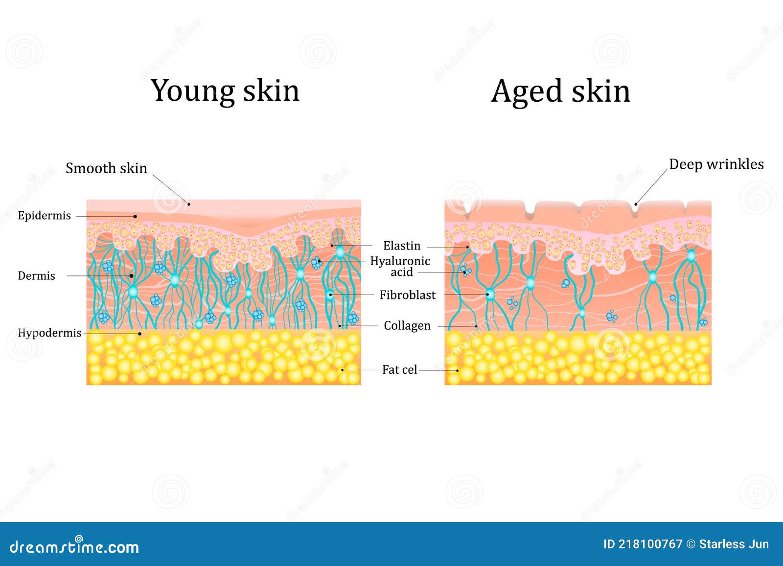 Vector Illustration of Age-related Changes in the Skin. Comparison of ... Vector Illustration of Age-related Changes in the Skin. Comparison of ...