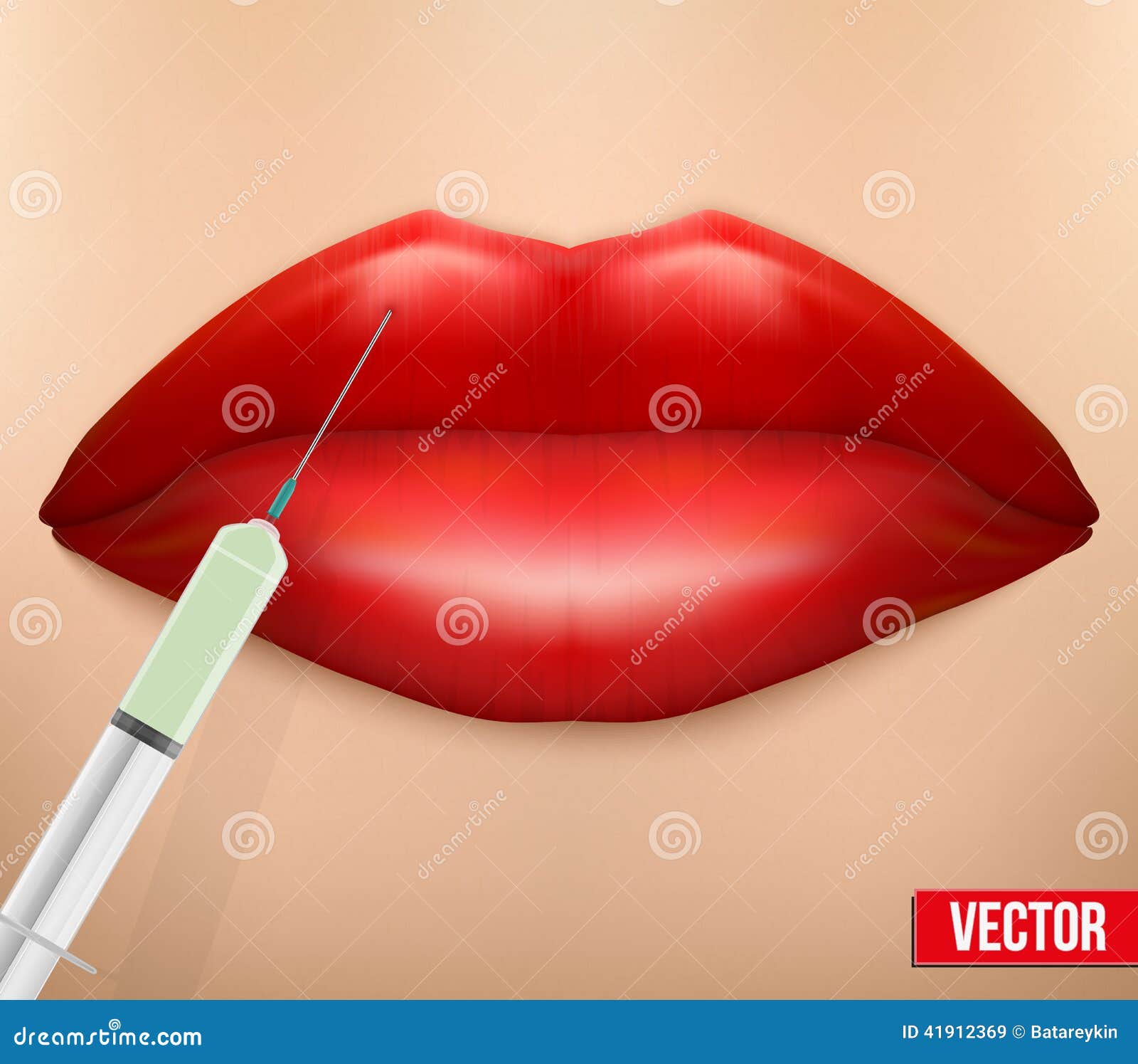 Vector Illustration of a Botox Injection. Stock Vector - Illustration ...