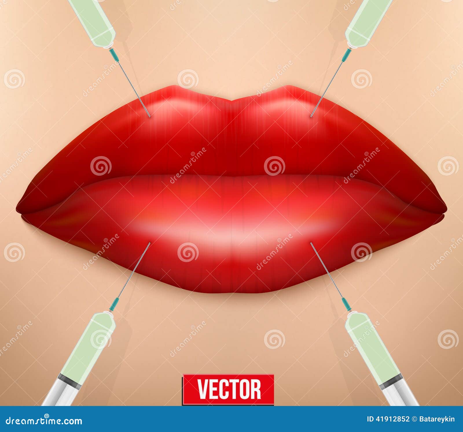 Vector Illustration of a Botox Injection. Stock Vector - Illustration ...