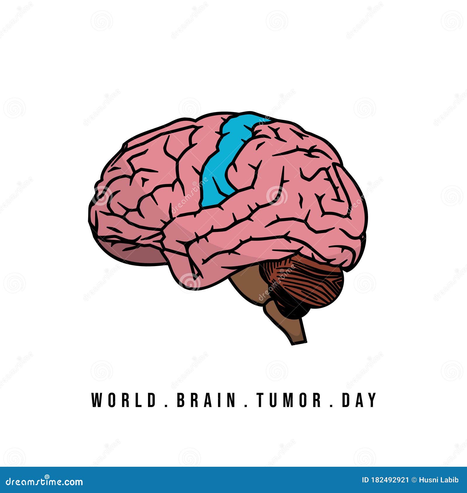 Vector Illustration of Brain with Brain Tumor Concept Design Stock ...